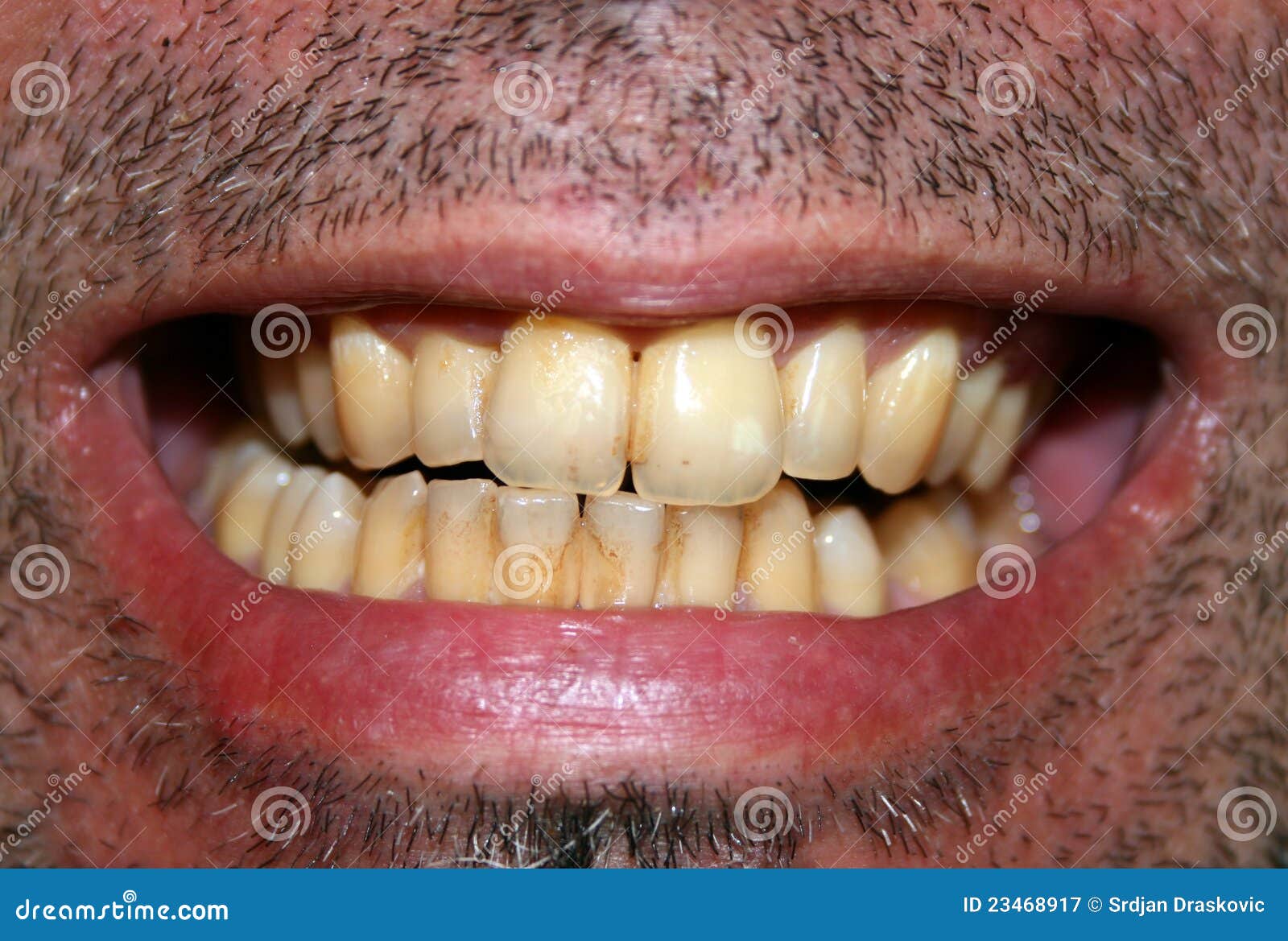 Dents jaunes image stock. Image du masculin, tabac, visage - 23468917