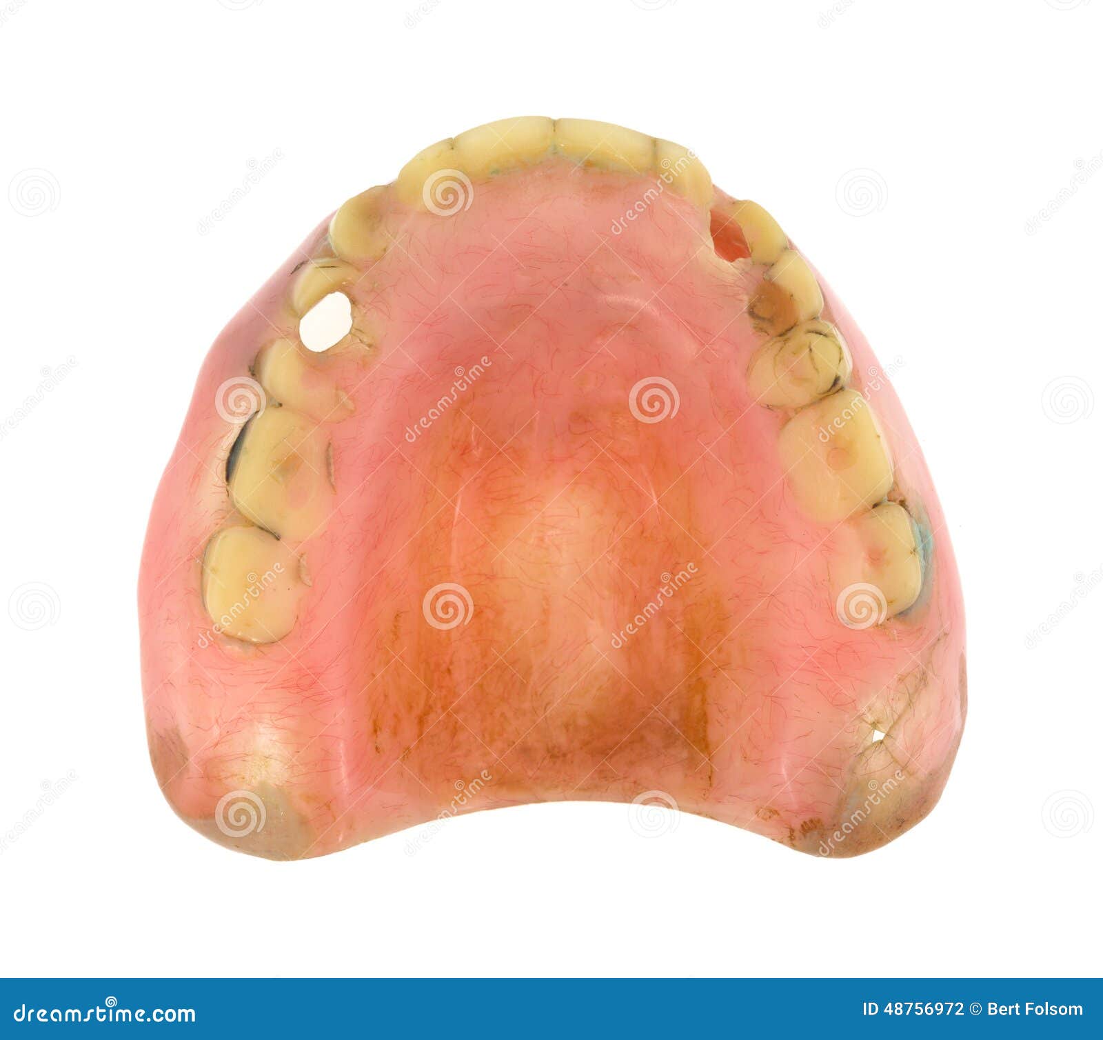 Dents Utilisées De Dentier De Vue Supérieure Photo stock - Image du ...