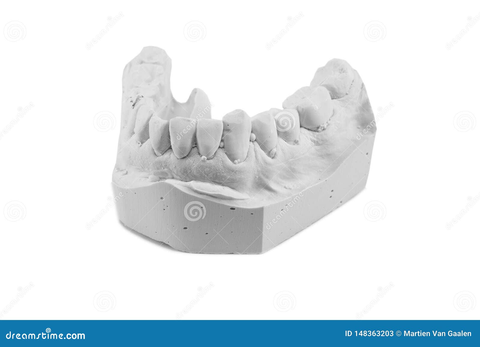 Denture Gypsum Print Plaster Teeth Model Isolated On White Background ...