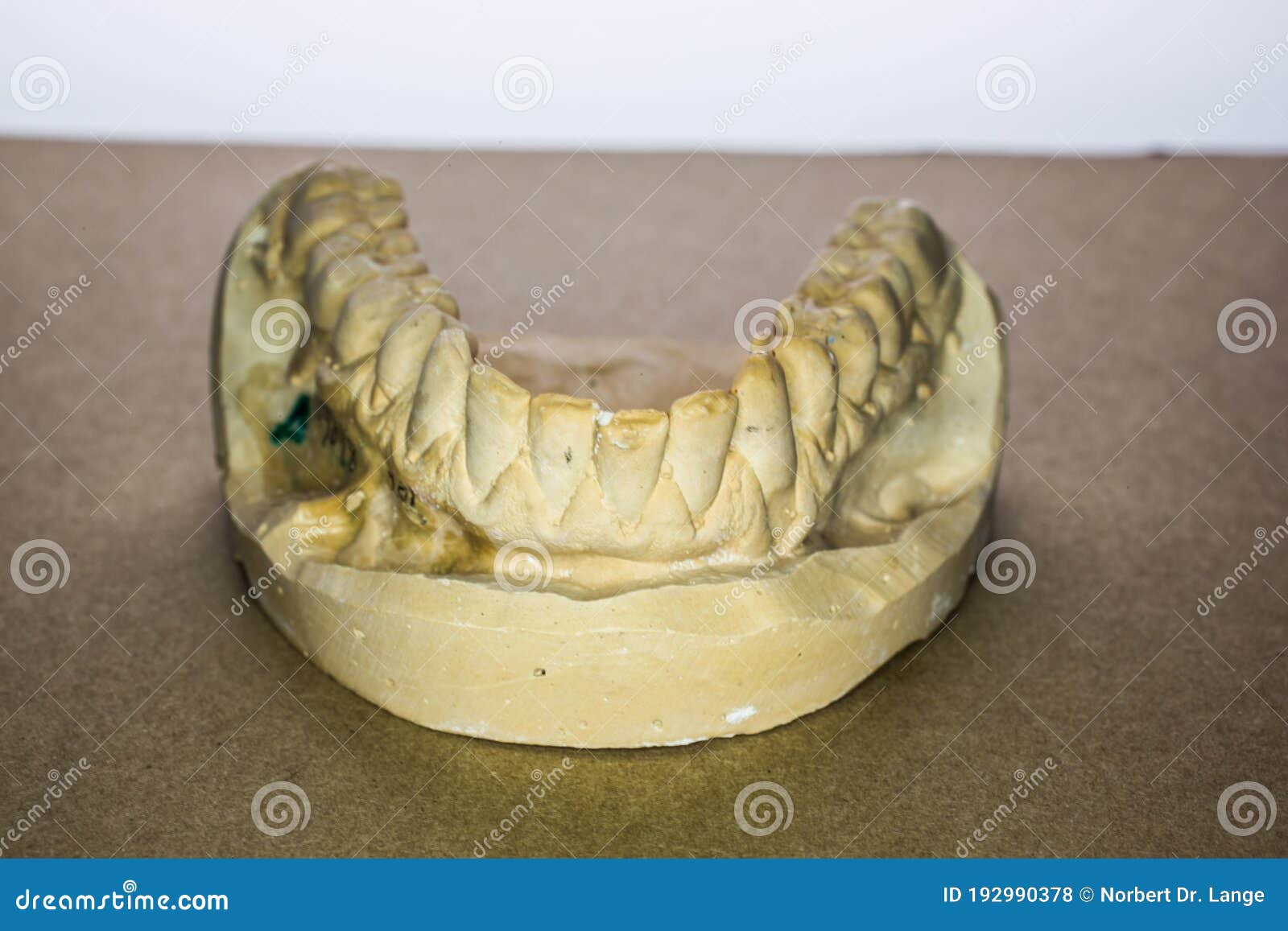 Denture Impression Made of Plaster with Implants Stock Photo - Image of ...