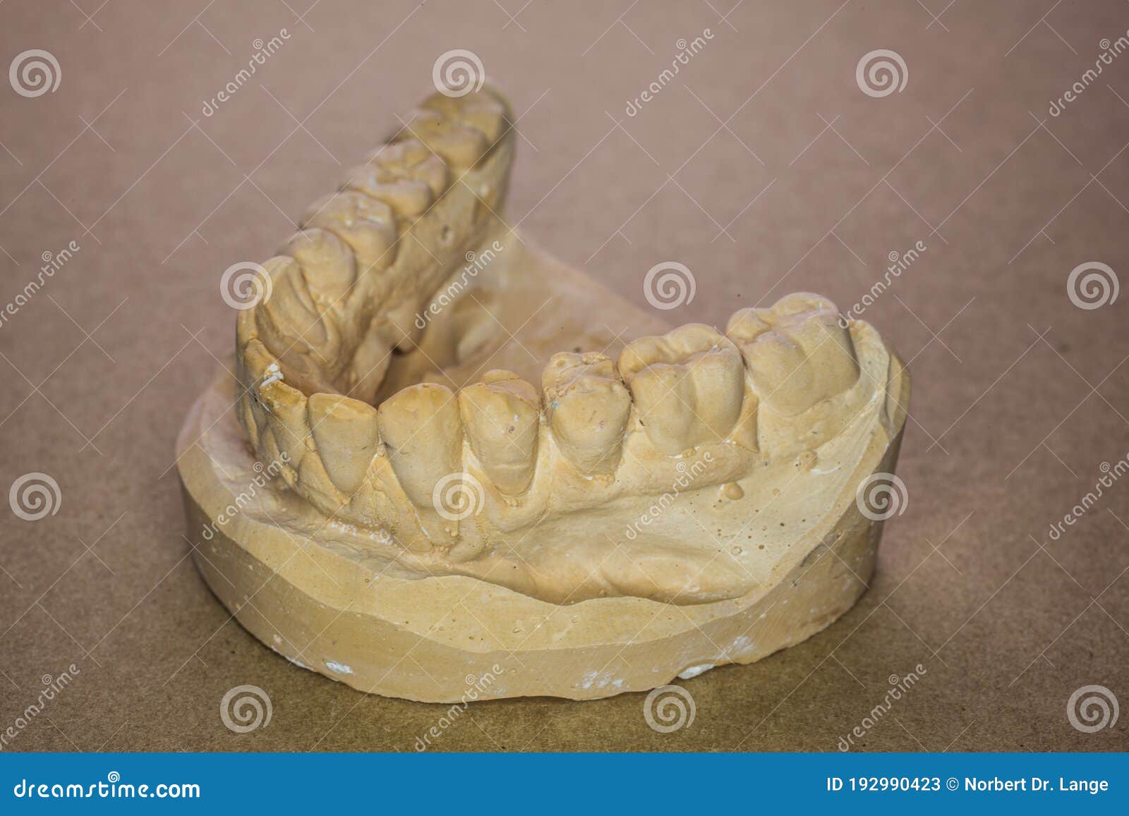 Denture Impression Made of Plaster with Implants Stock Image - Image of ...