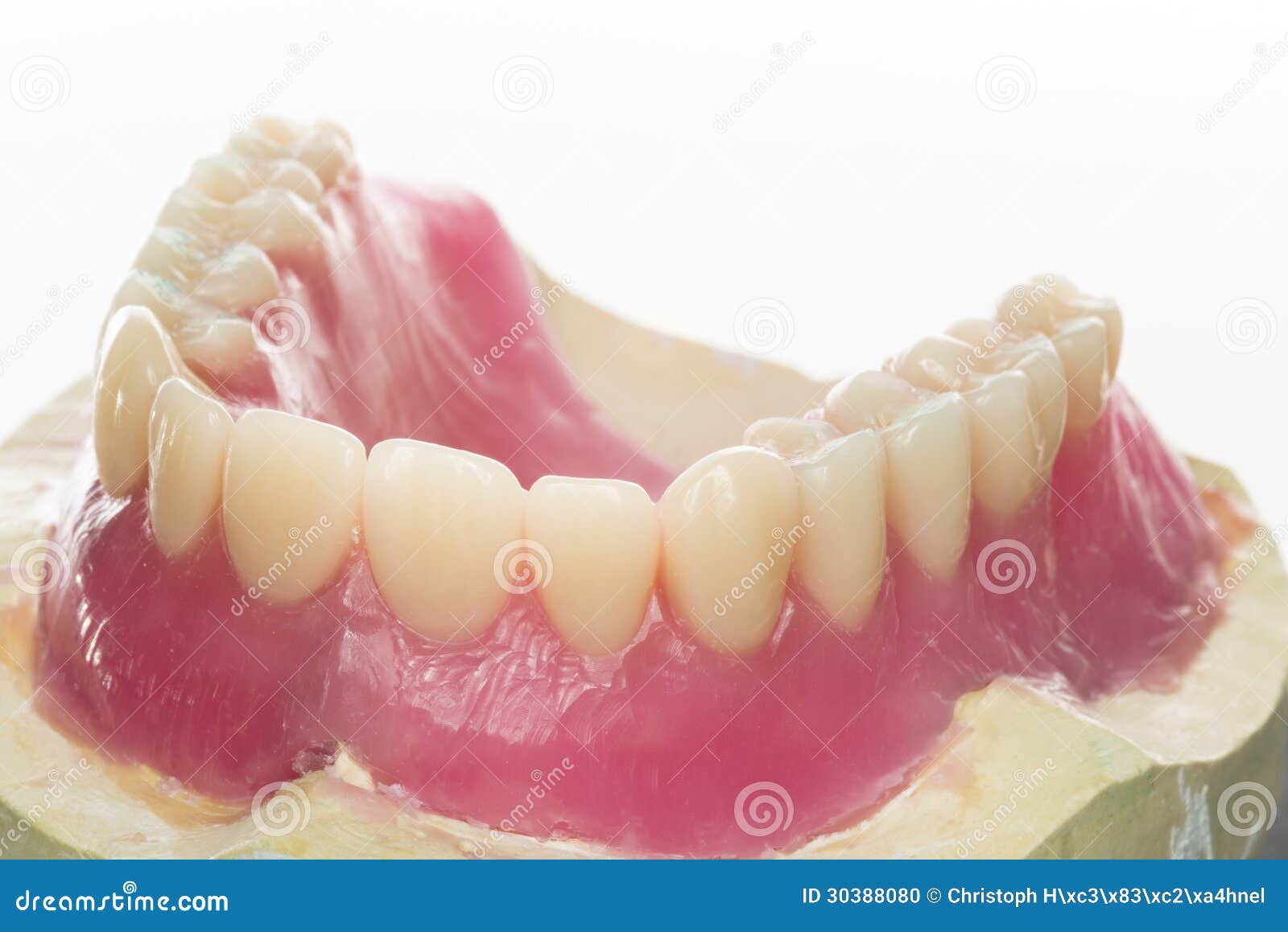 Isolated Denture On A White Background. Dental Prosthesis Care. Full ...