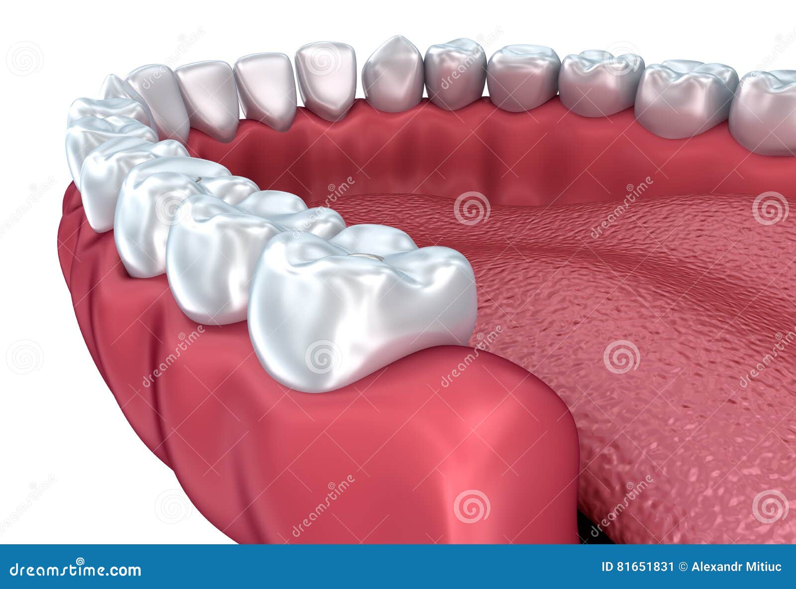 Denture Isolated On White Royalty-Free Cartoon | CartoonDealer.com ...