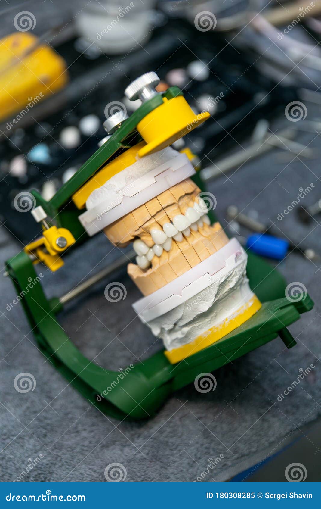 Denture Layout. a Model of Human Teeth Fixed in Special Clamps Stock ...