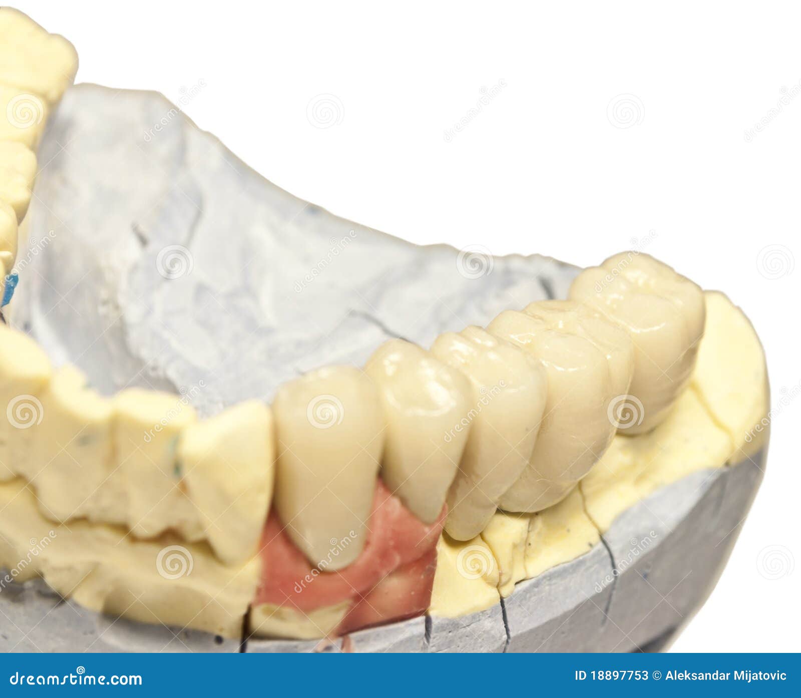 Denture model stock image. Image of figure, molar, dentist - 18897753