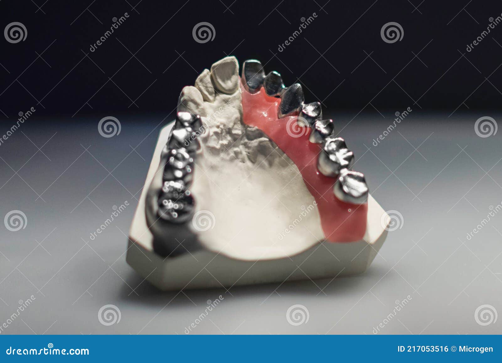 Denture model stock photo. Image of people, technology - 217053516