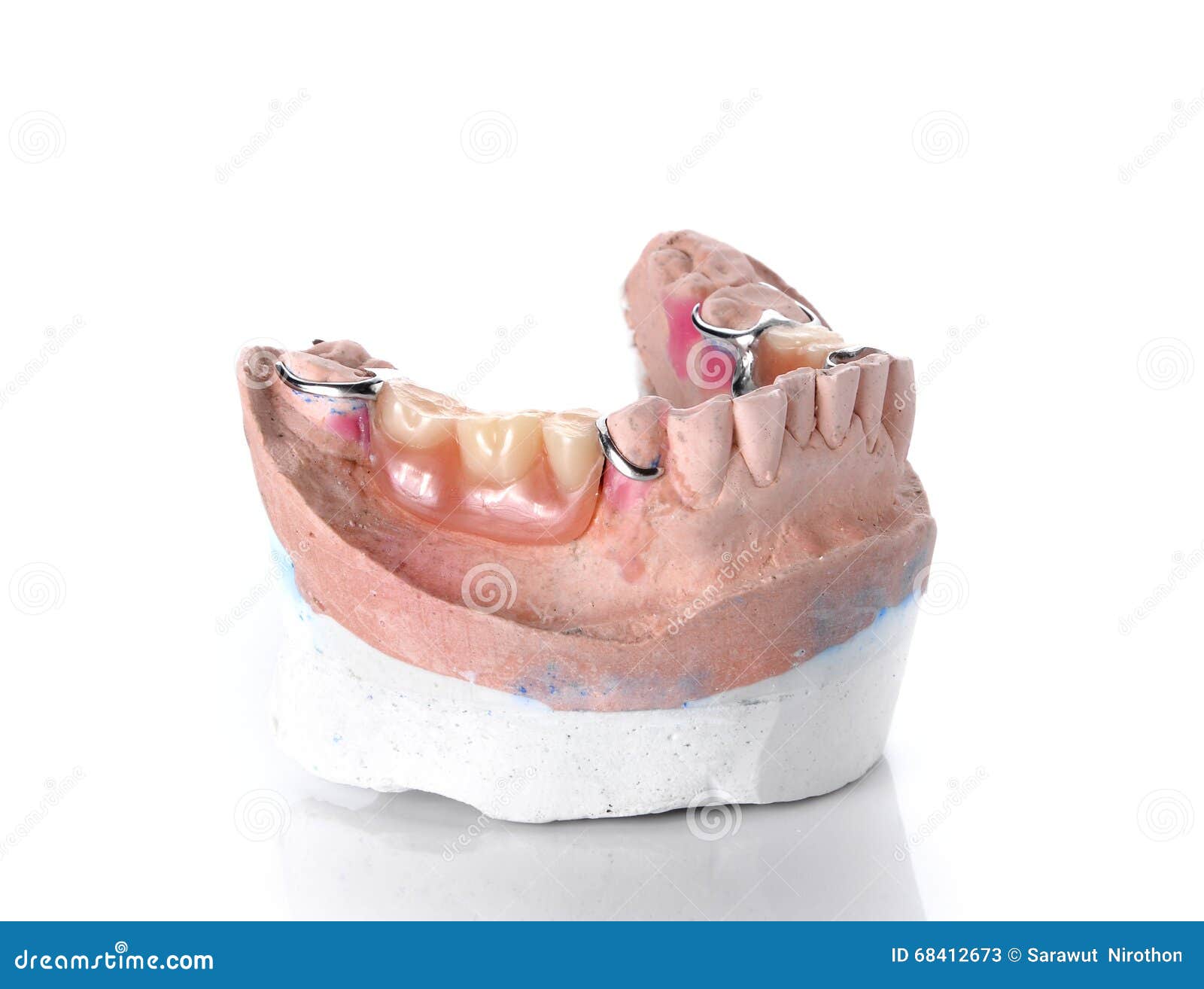 Denture Mold, False Teeth on White Background. Stock Image - Image of ...