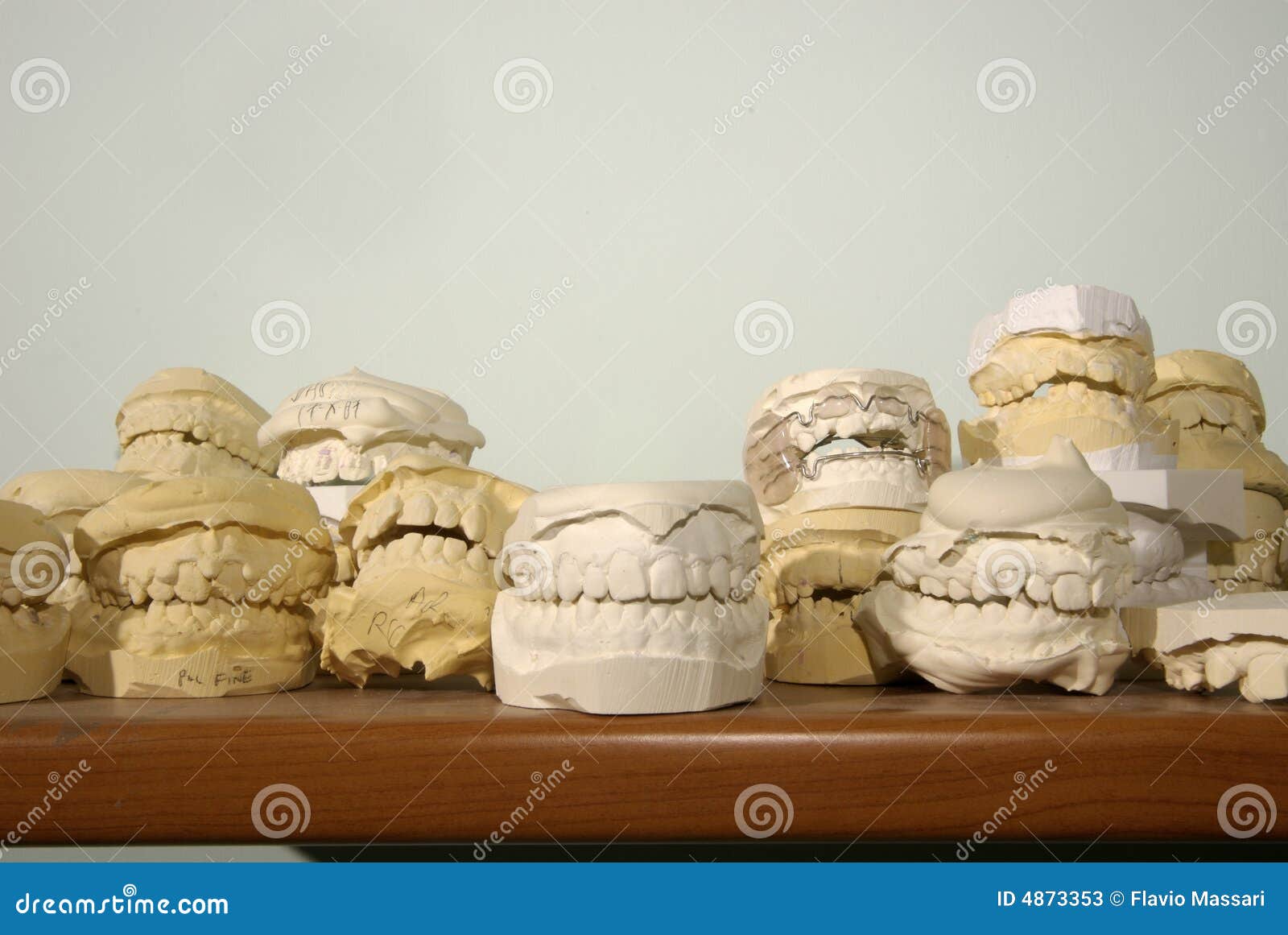 Plaster Casts Of Victim Of Eruption Mount Vesuvius And Ancient Pottery ...
