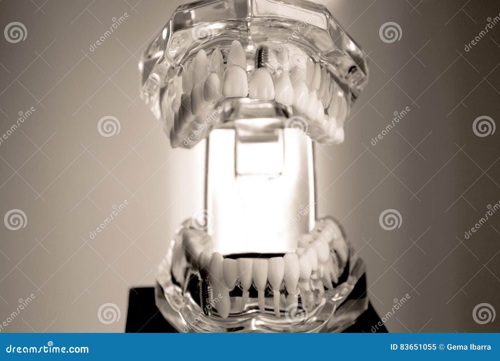 Denture for Students Transparent Stock Image - Image of anatomy, care ...