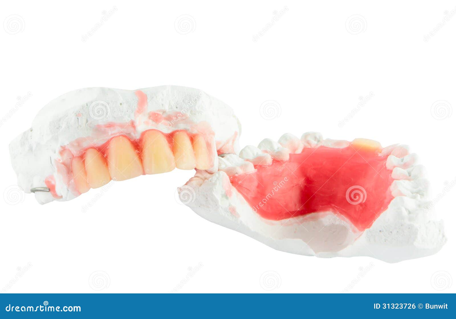 Denture Teeth with Wax Model Isolate Stock Photo - Image of bite ...