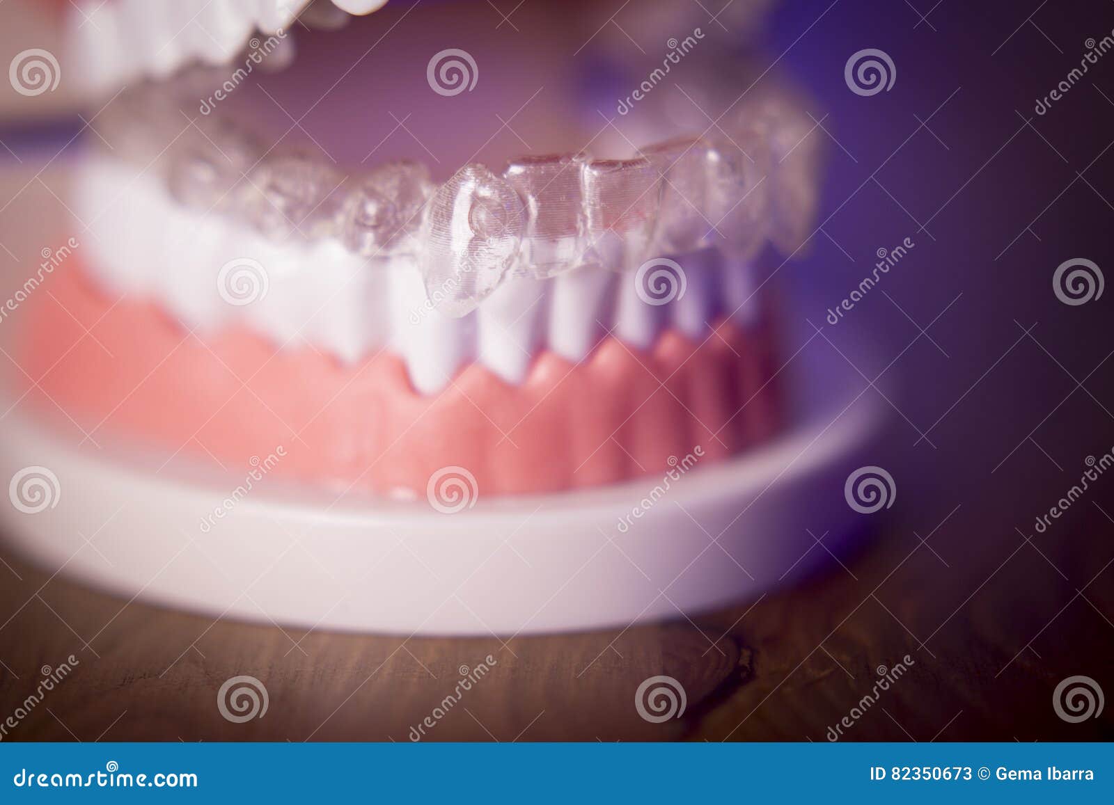 Denture with Transparent Orthodontics Stock Image - Image of ...