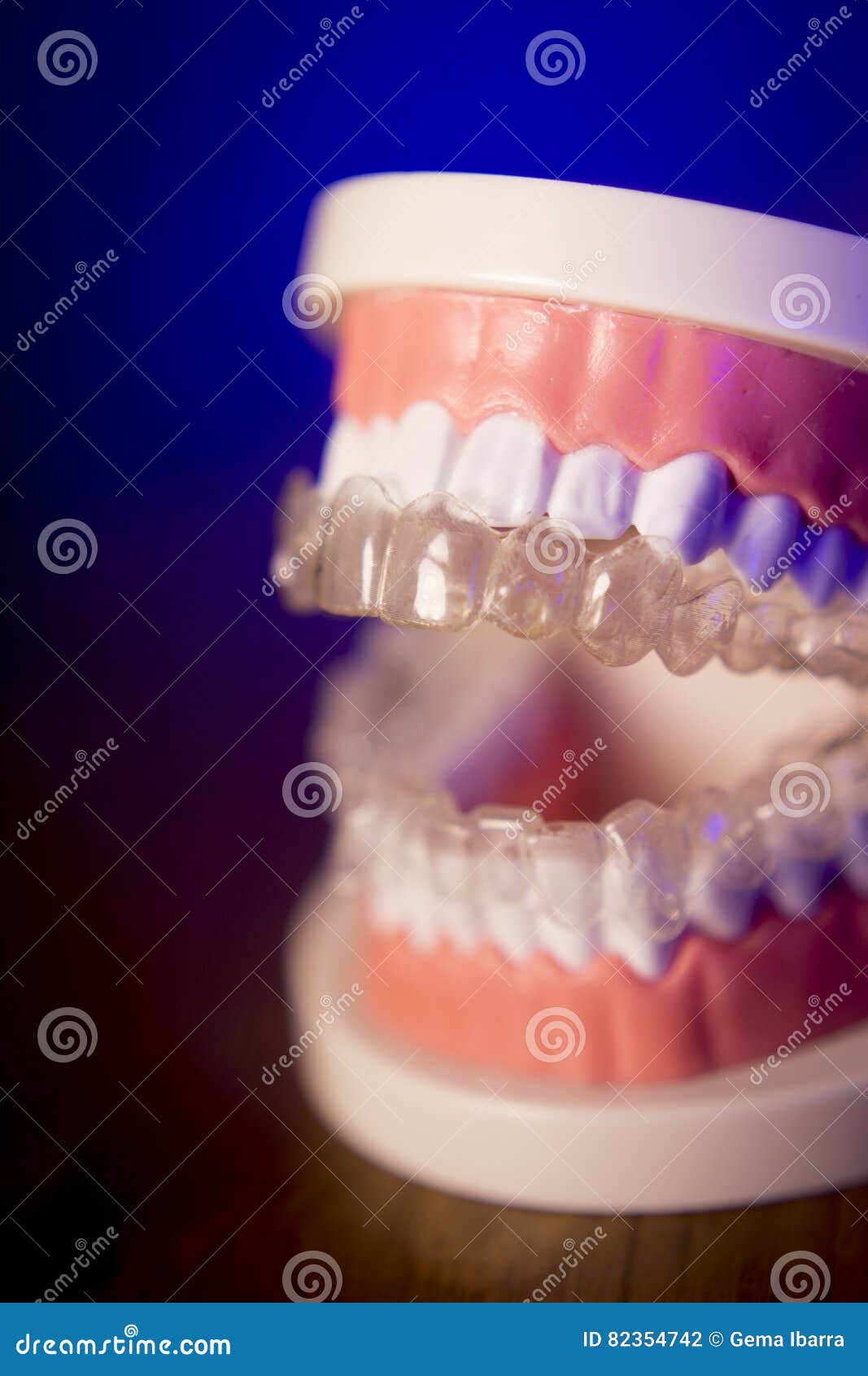 Denture with Transparent Orthodontics Stock Photo - Image of isolated ...