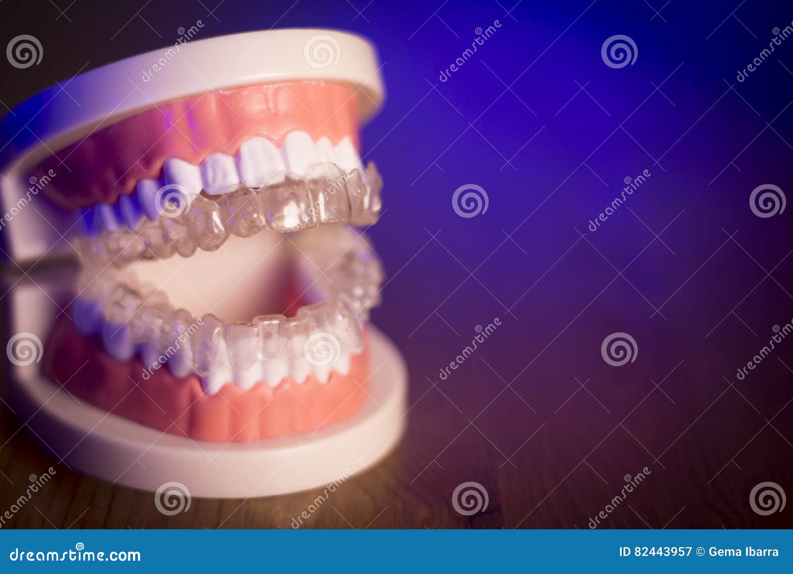 Denture with Transparent Orthodontics Stock Image - Image of ...
