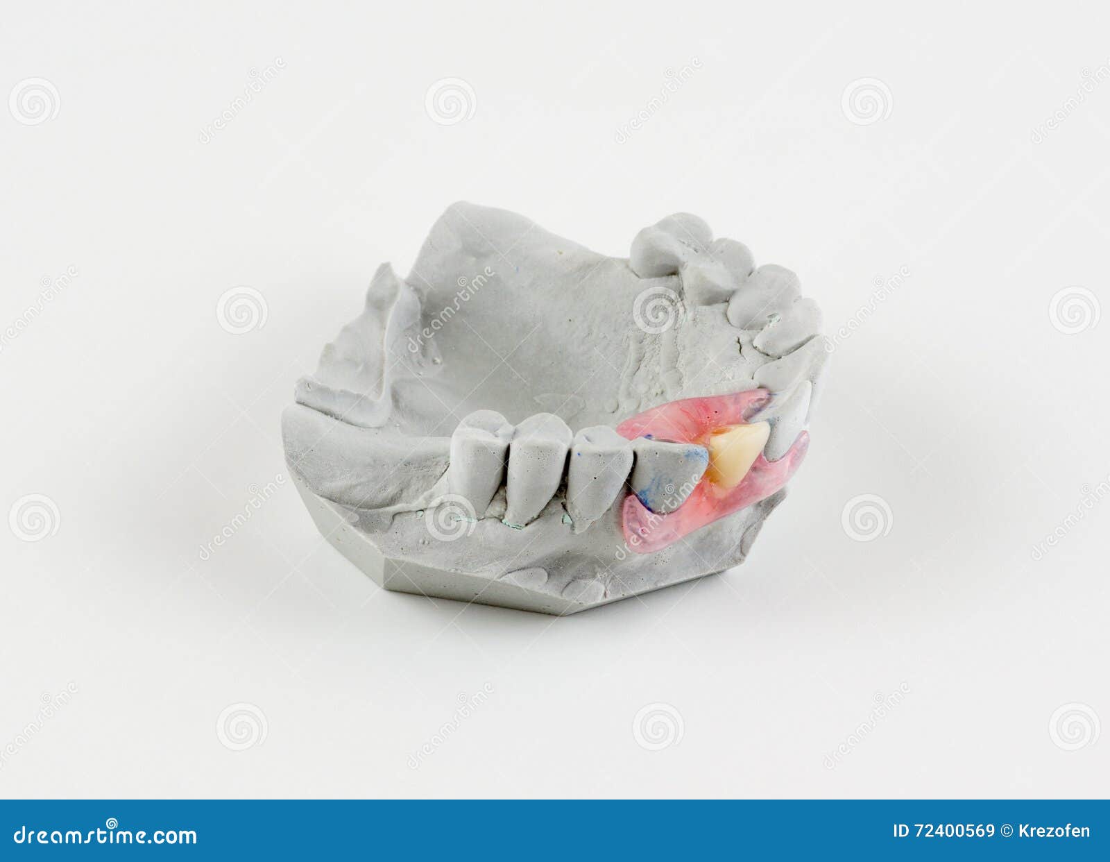 Denture type butterfly stock image. Image of dental, healthcare - 72400569