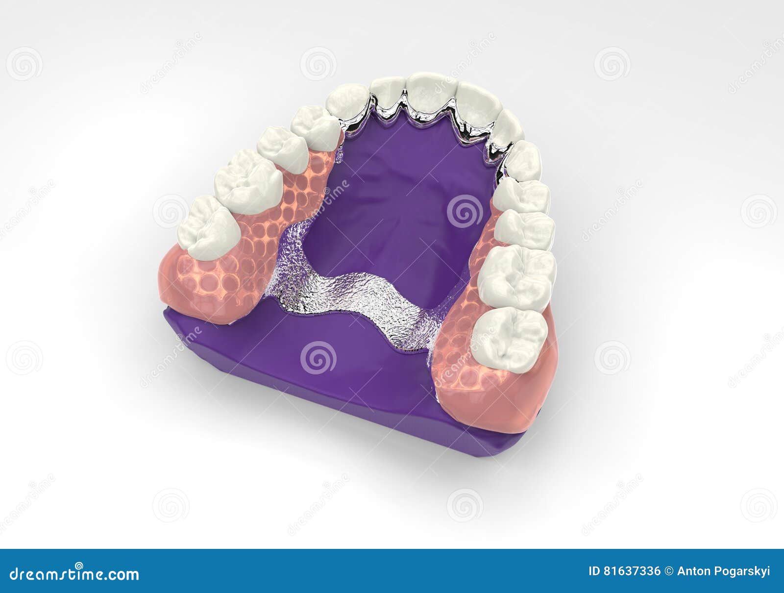 Dentures stock illustration. Illustration of renderingmodel - 81637336