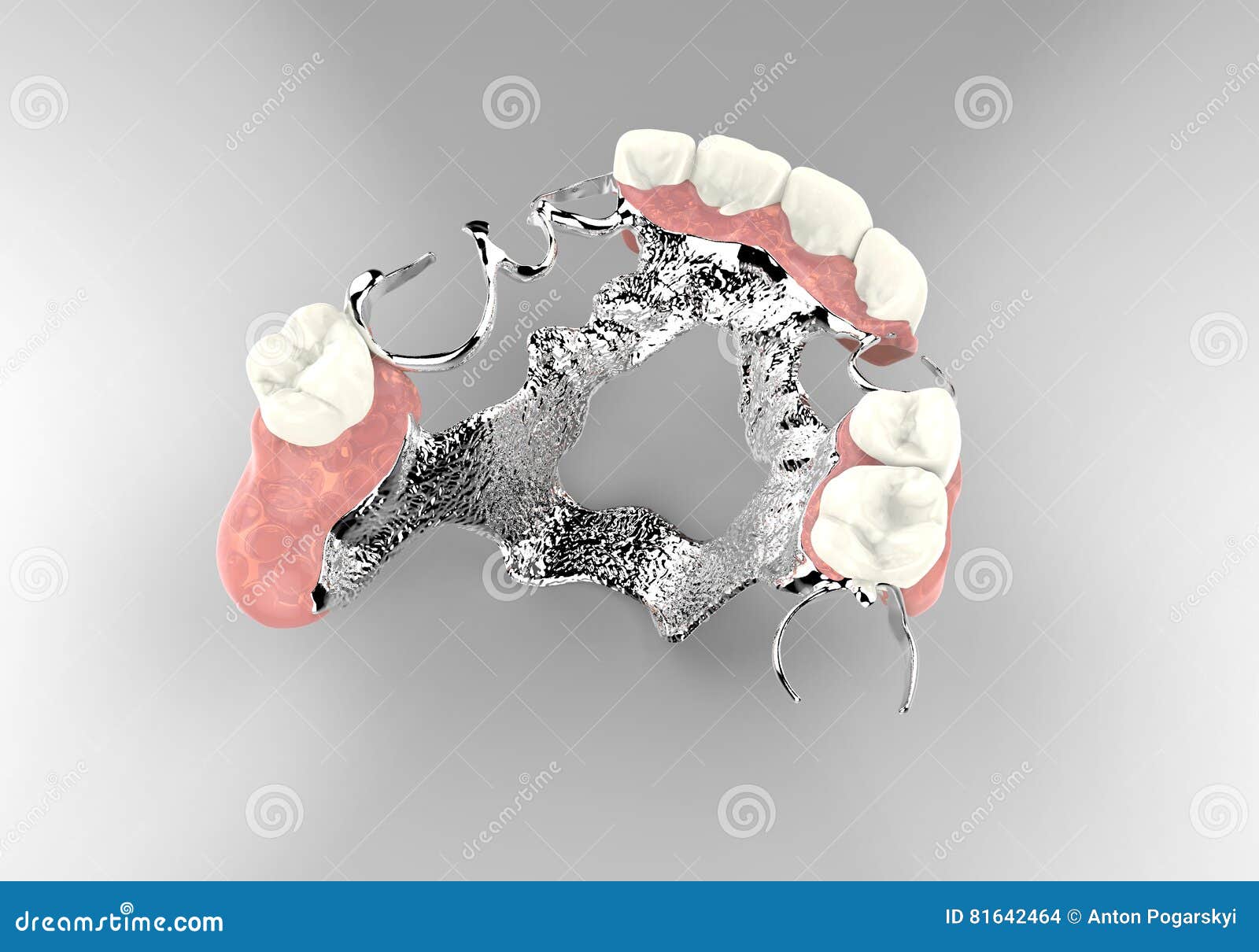 Dentures stock illustration. Illustration of prothesis - 81642464