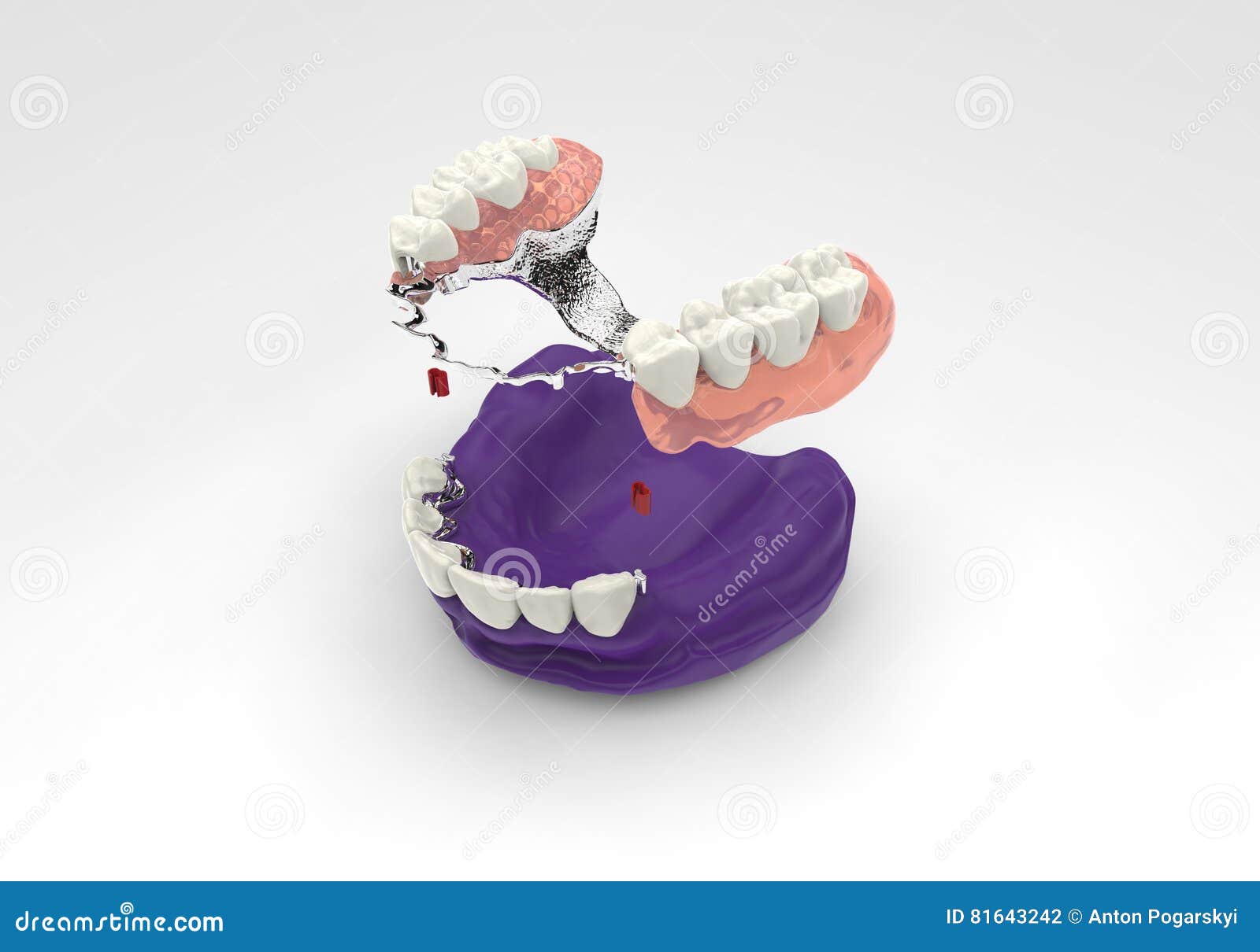 Dentures stock illustration. Illustration of dentist - 81643242
