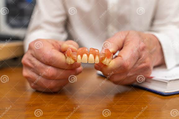 Dentures in the Hands of a Man in a White Coat. Stock Photo - Image of ...