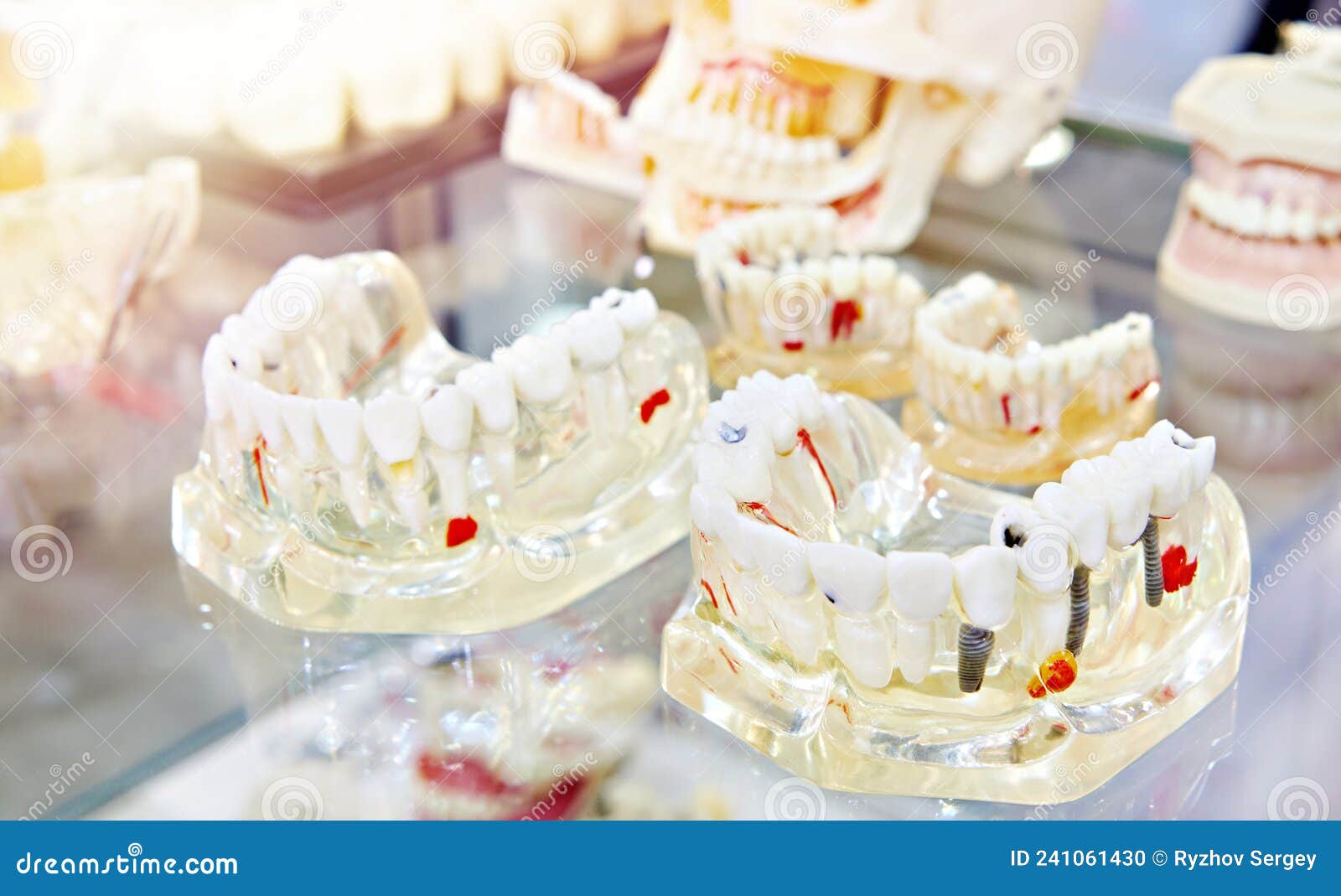 Dentures Teeth Dummies in Dental Store Stock Photo - Image of human ...