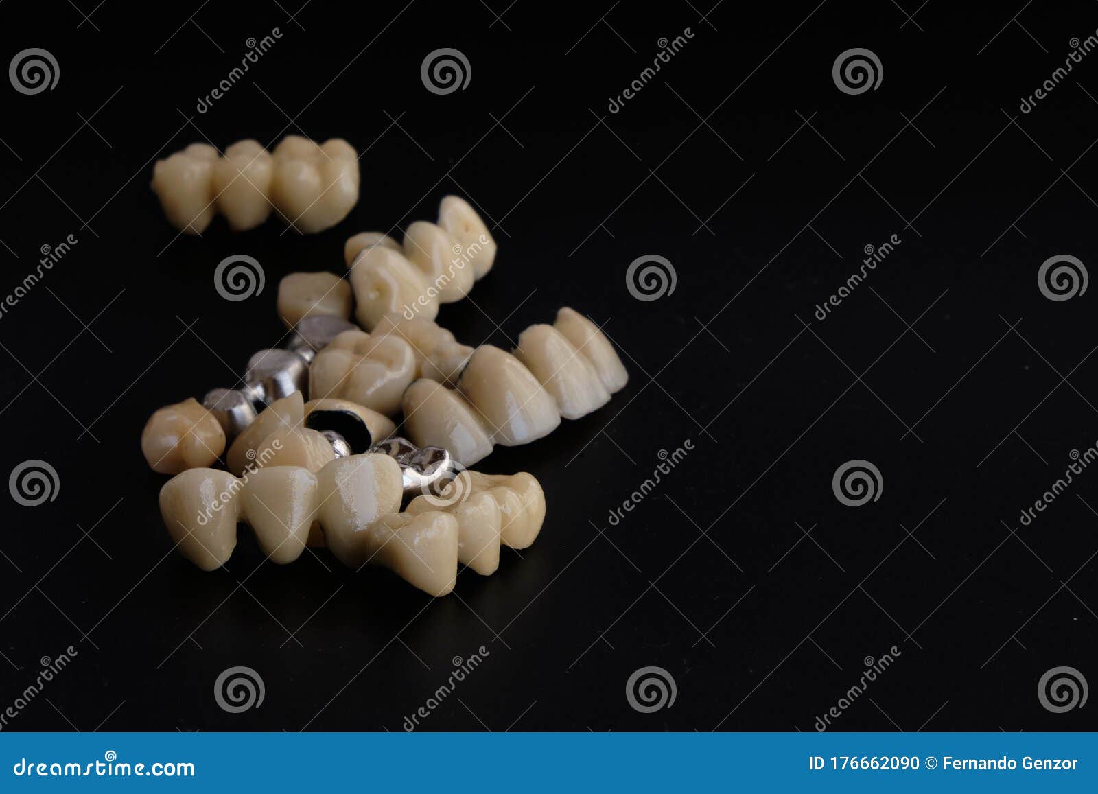 Dentures and Various Elements of a Dental Prosthesis for Dentists and ...
