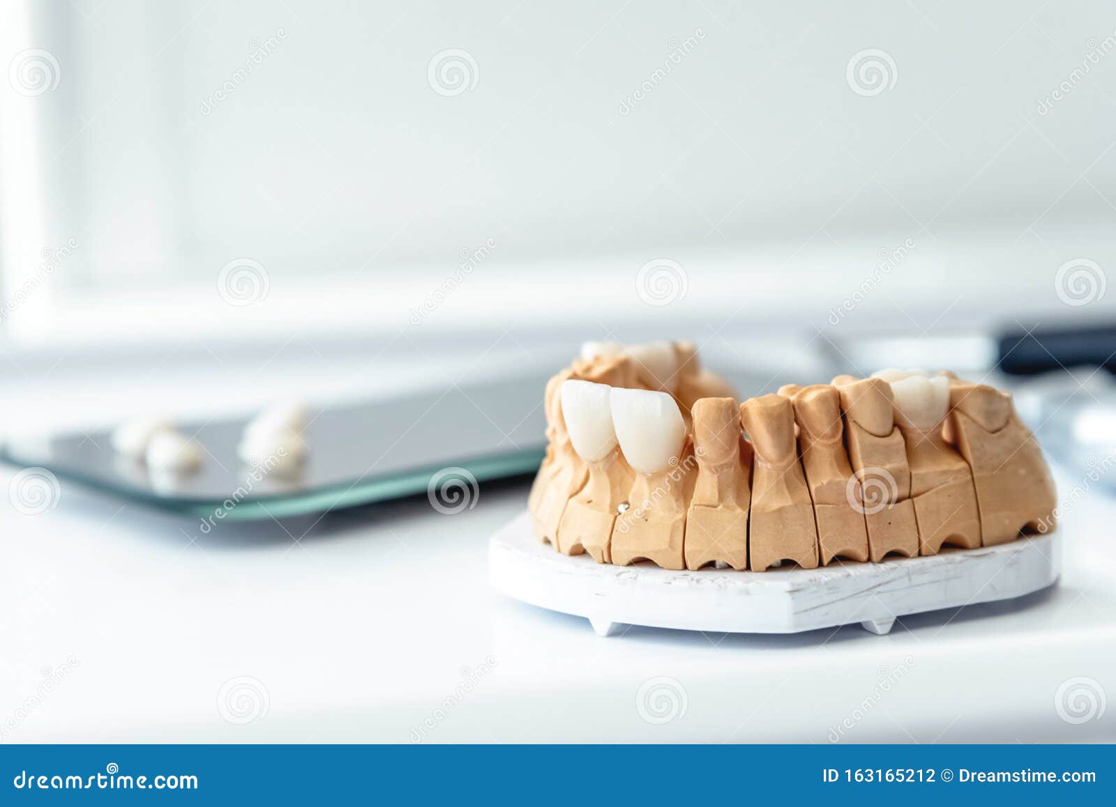 Dentures, Veneers, Crowns, Implants are Made in a Dental Laboratory ...