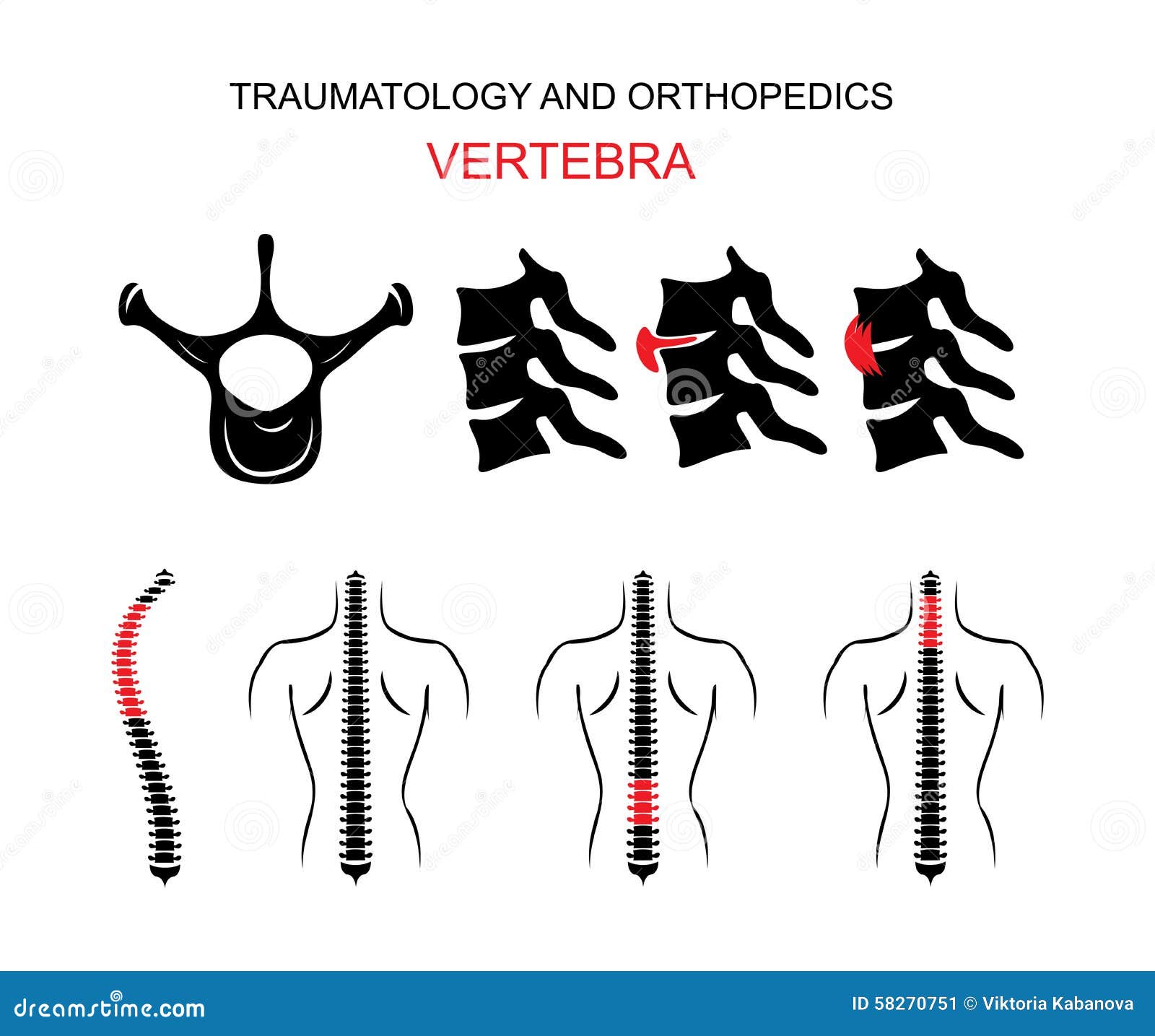Der Dorn vektor abbildung. Illustration von arthrose - 58270751
