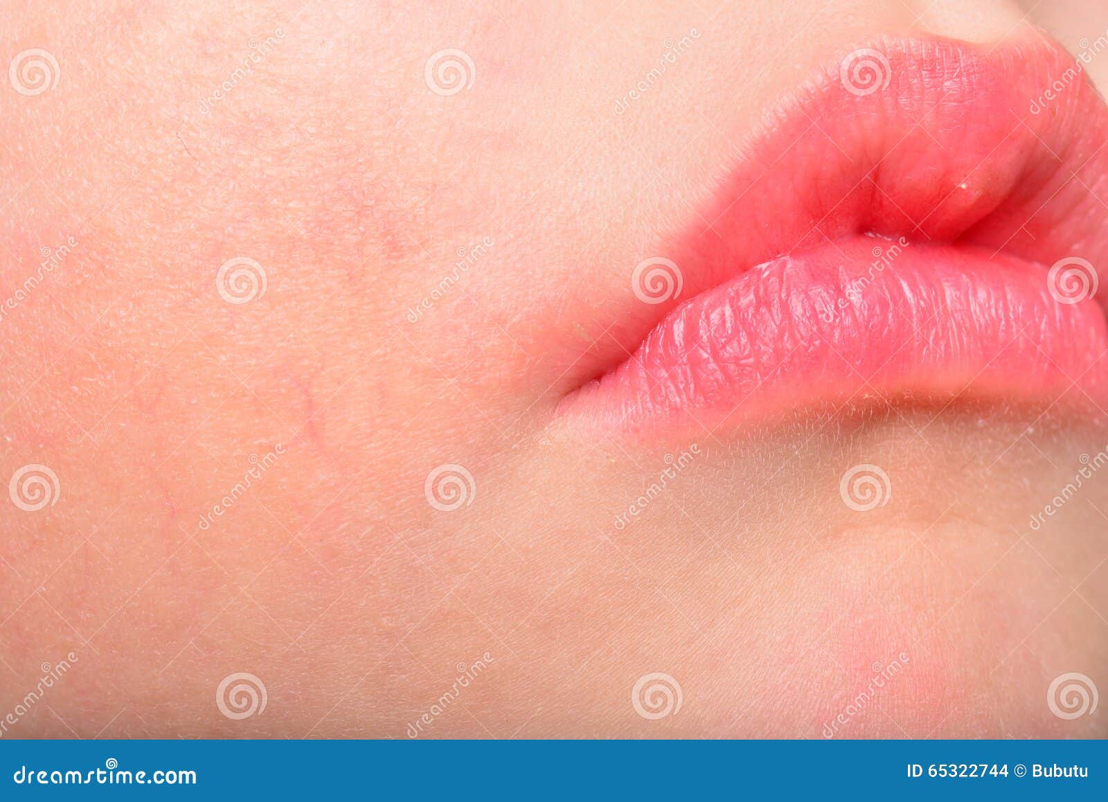 Dermatite atopique photo stock. Image du médecine, douleur - 65322744