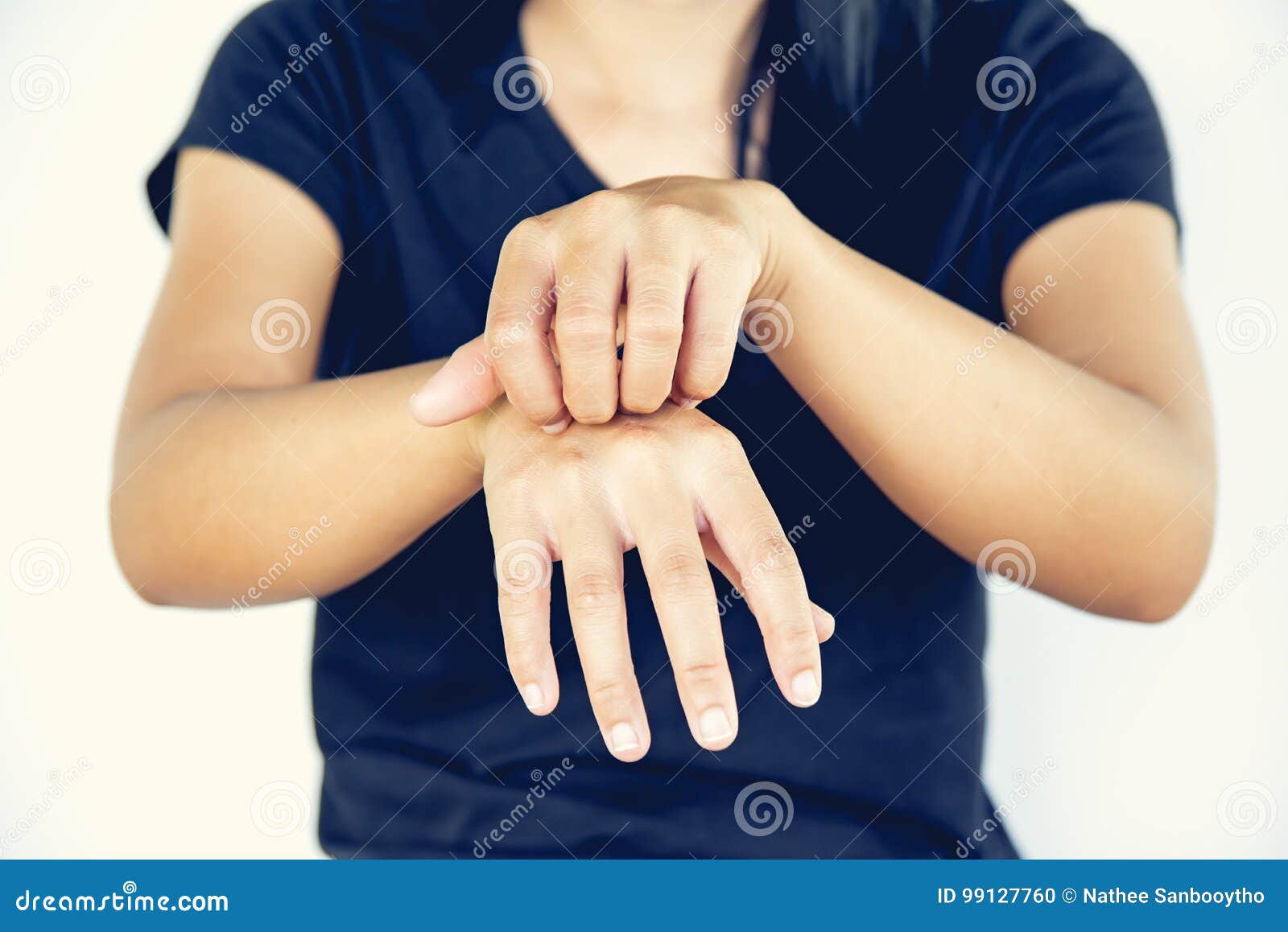Dermatitis ,scratch the Itch with Hand Stock Photo - Image of adult ...