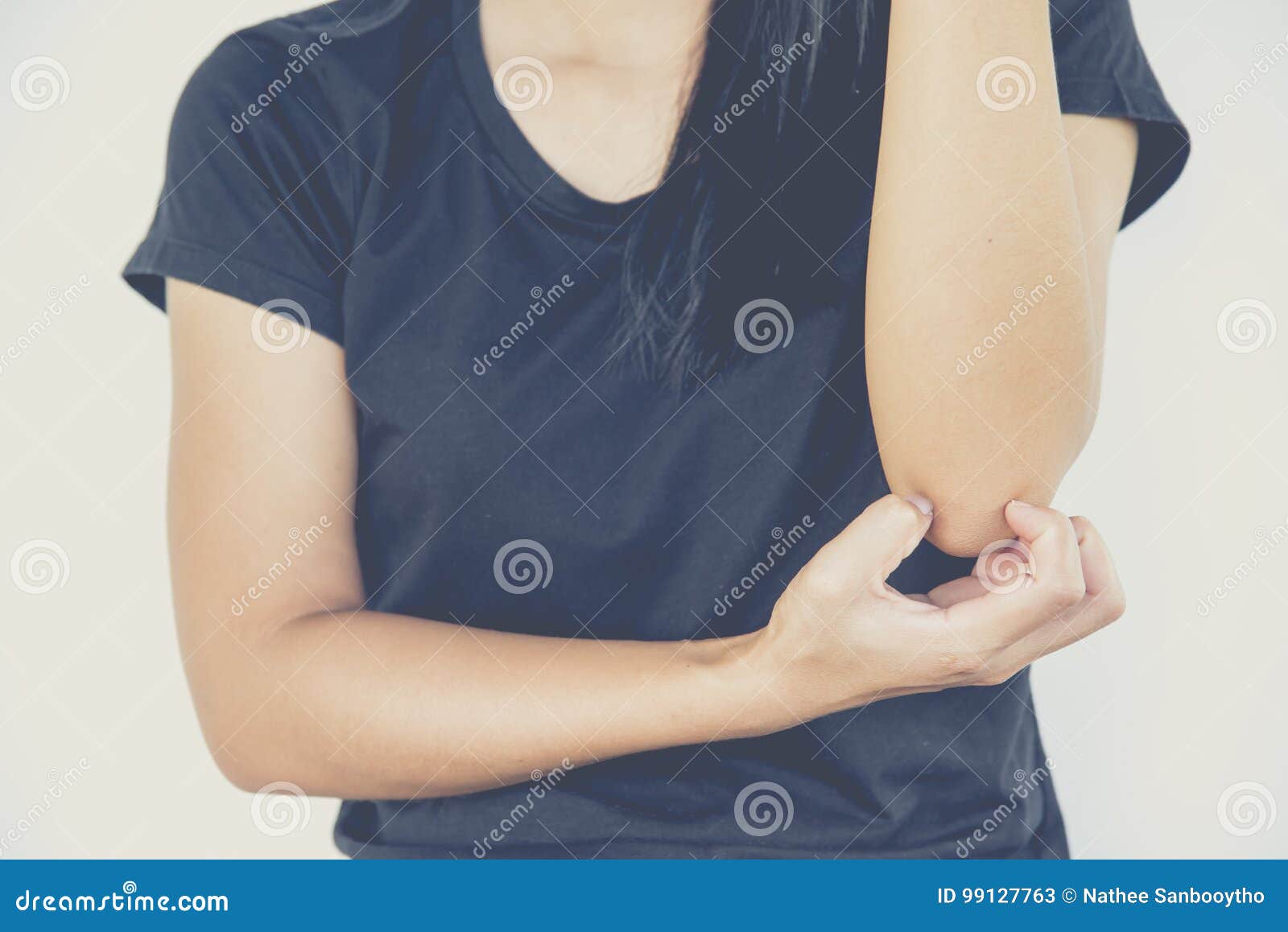 Dermatitis ,scratch the Itch with Hand Stock Image - Image of medicine ...
