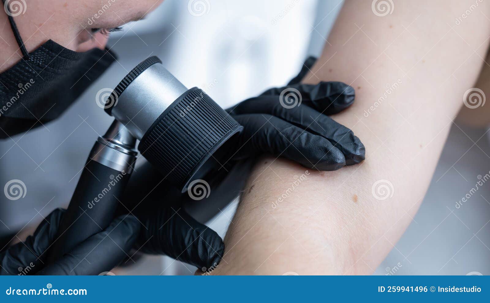 A Dermatologist Examines a Patient S Mole through a Dermatoscope. Stock ...