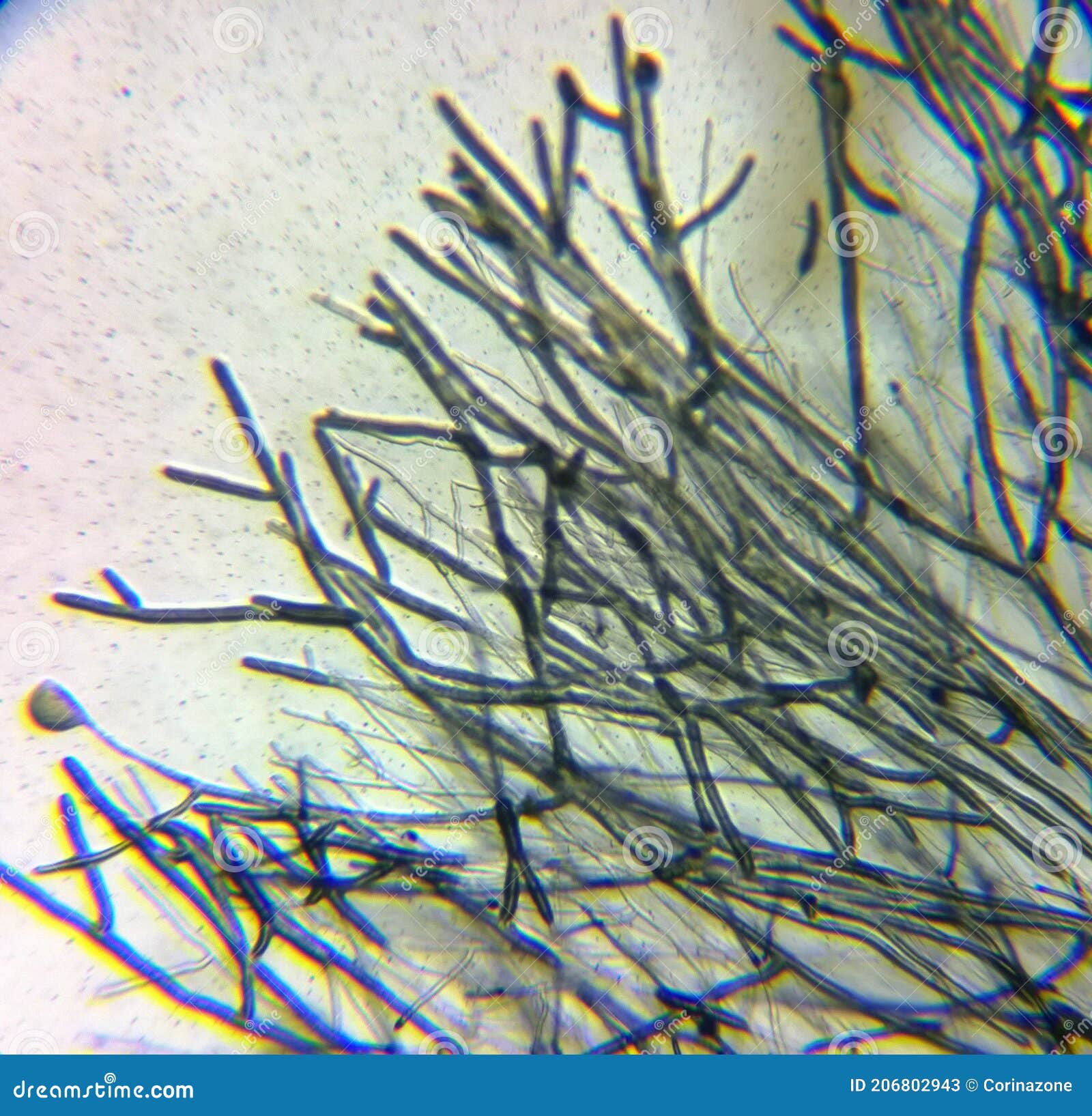 Dermatophyte Fungual Mycelium And Candida Under The Microscope Stock ...