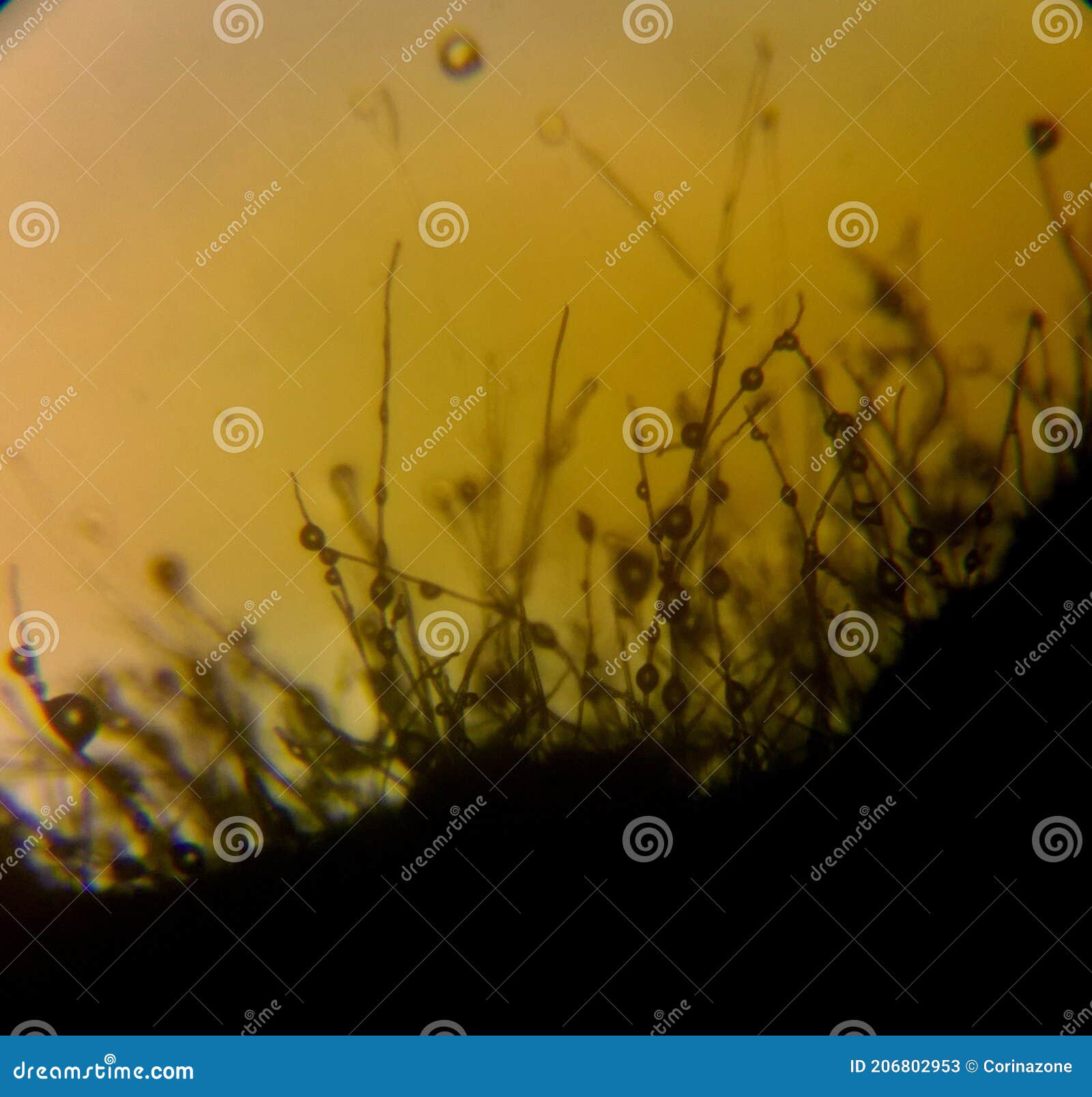 Dermatophyte Fungual Mycelium Under the Microscope Stock Image - Image ...