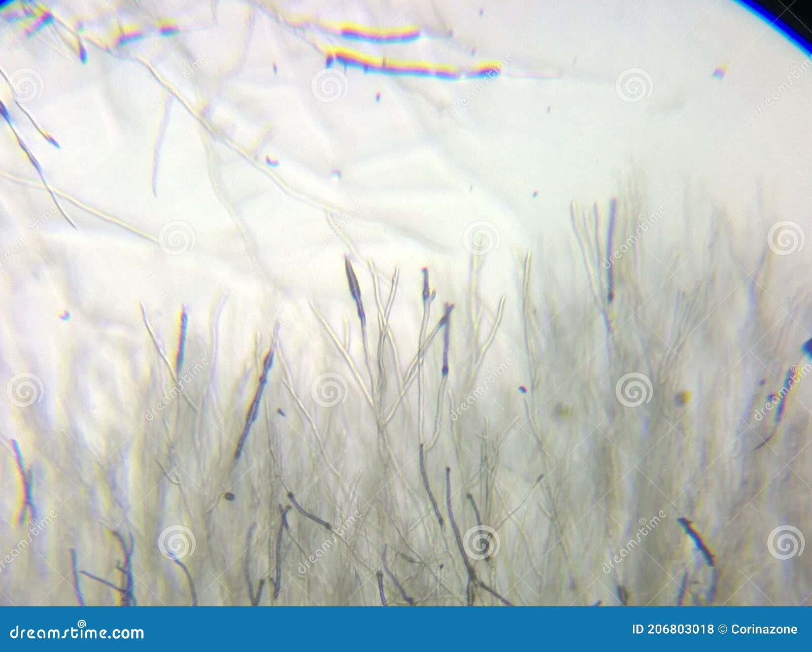 Dermatophyte Fungual Mycelium And Candida Under The Microscope Stock ...