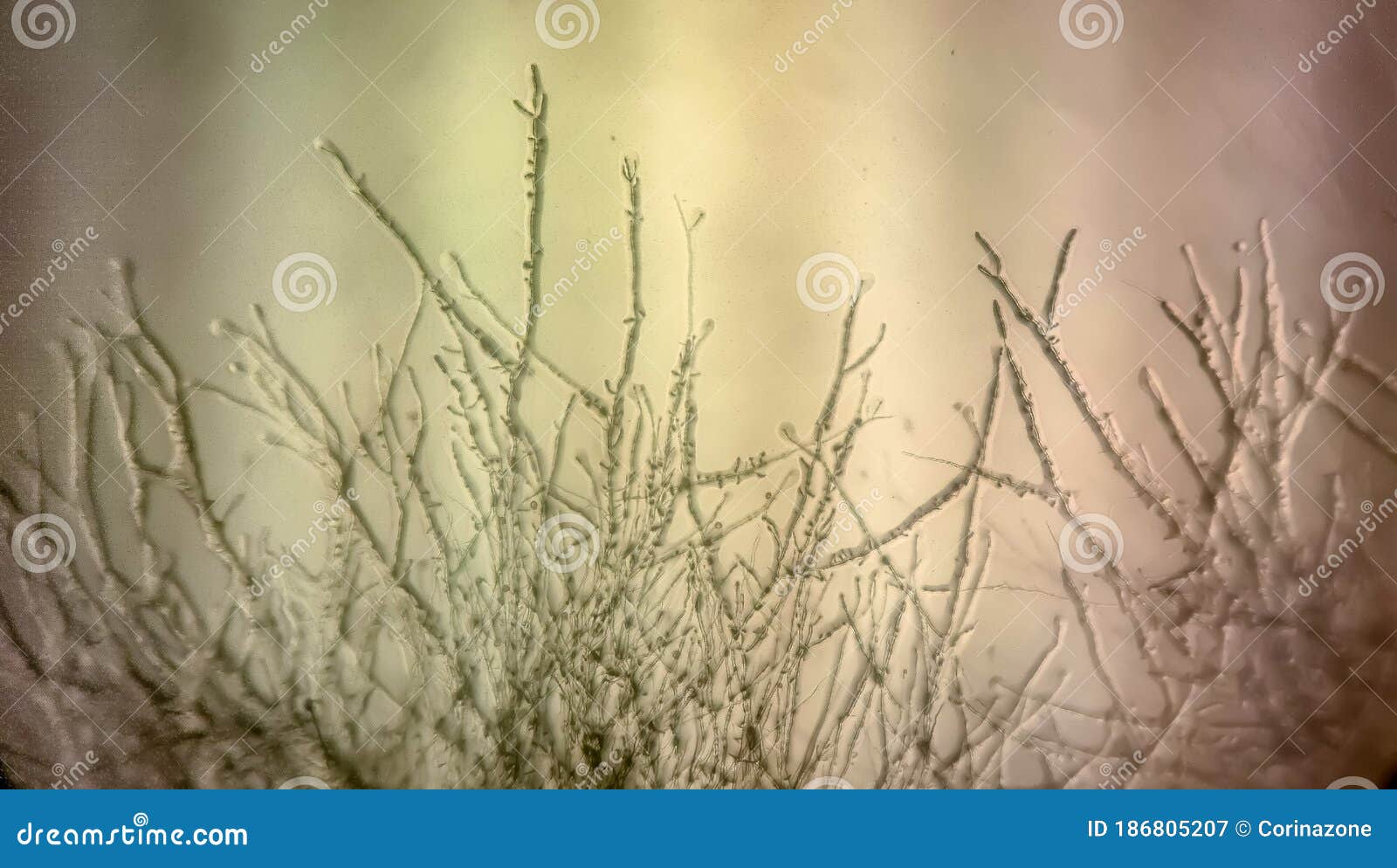 Microscope View of a Dermatophyte Fungus Stock Image - Image of fungus ...