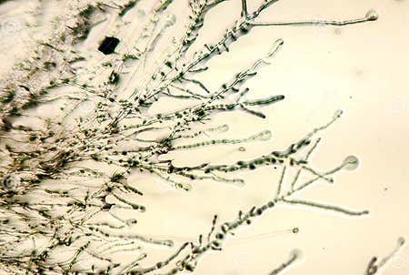 Dermatophyte Fungus Under the Microscope Stock Photo - Image of ...