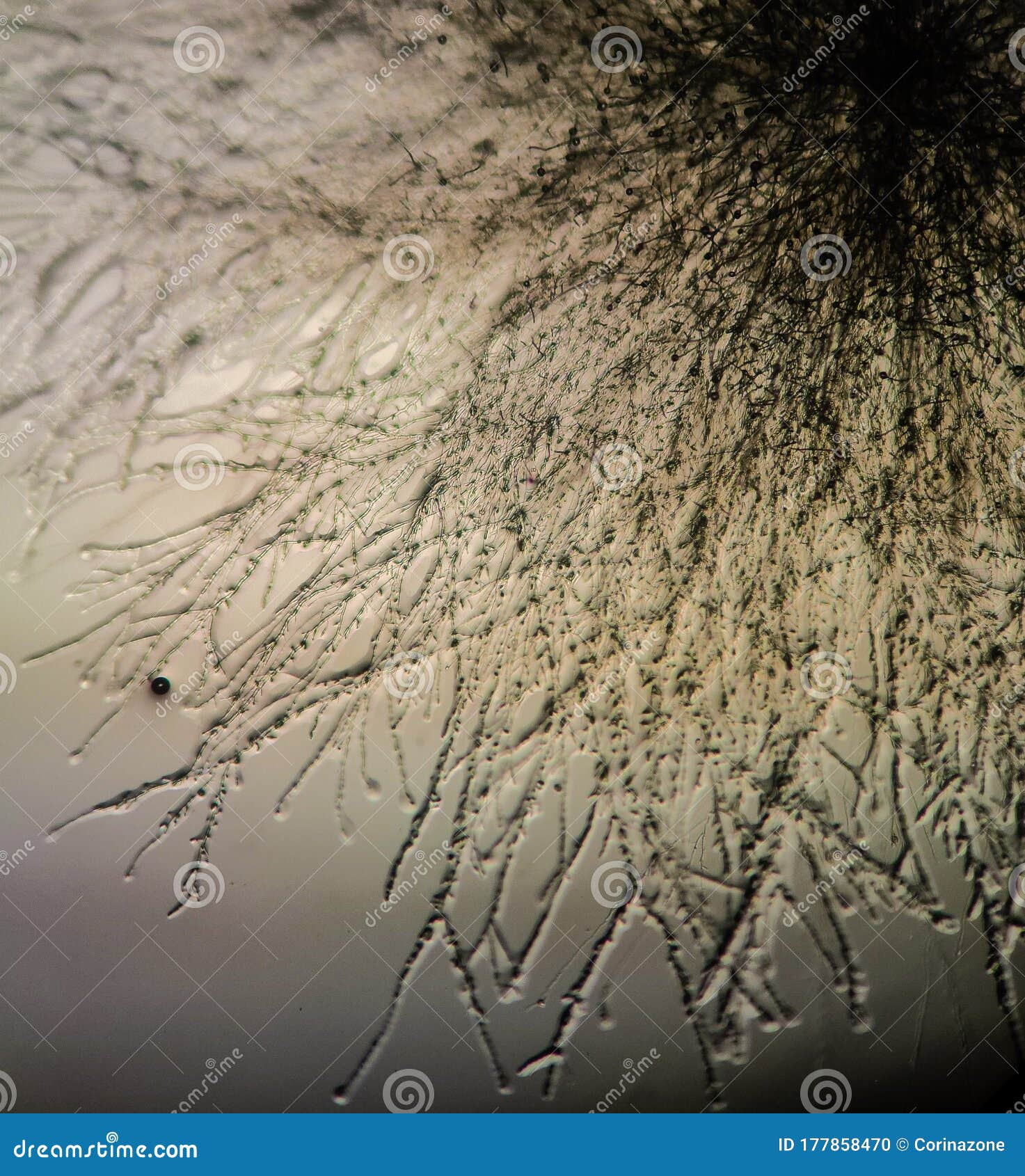 Dermatphyte Fungus Under the Microscope Stock Photo - Image of ...
