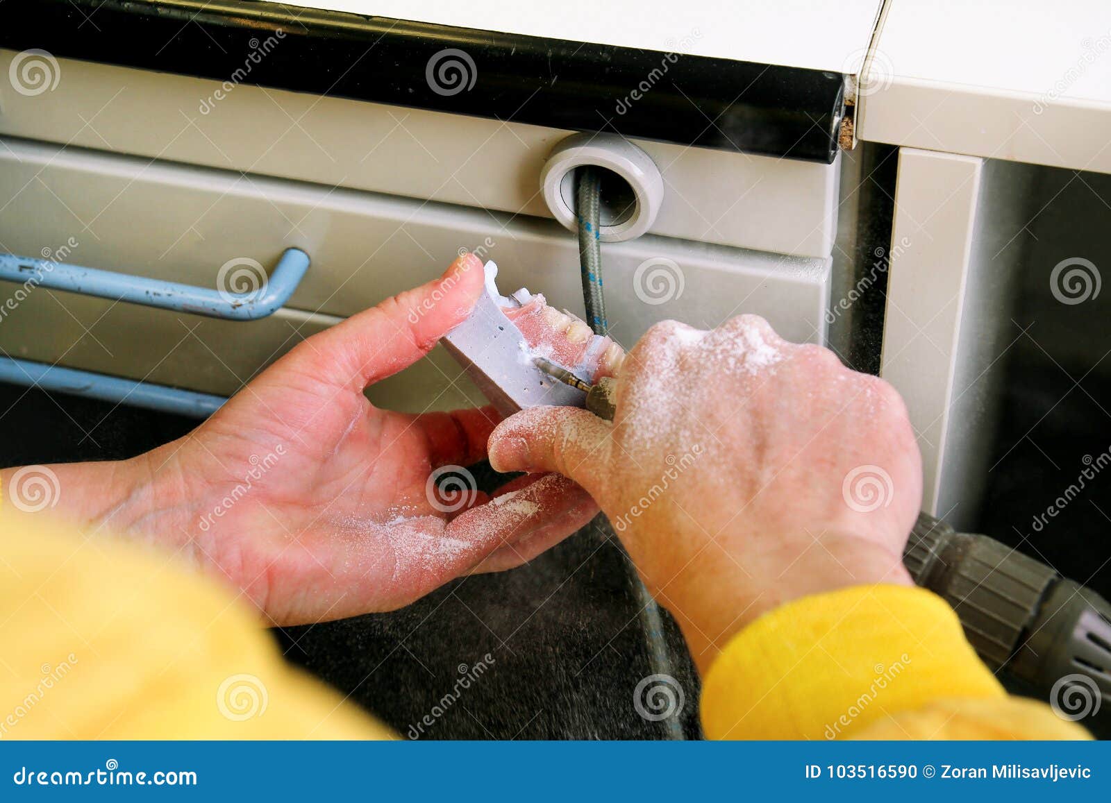 Detaching a Dental Prosthesis Form a Plaster Model Stock Photo - Image ...