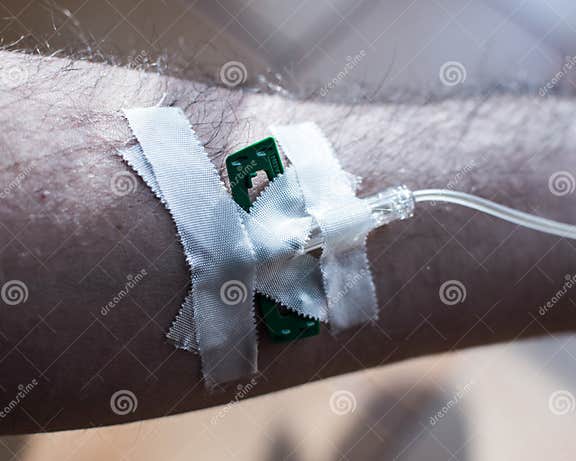 Detail of Arm with Drip Attached Stock Image - Image of gloves, mask ...