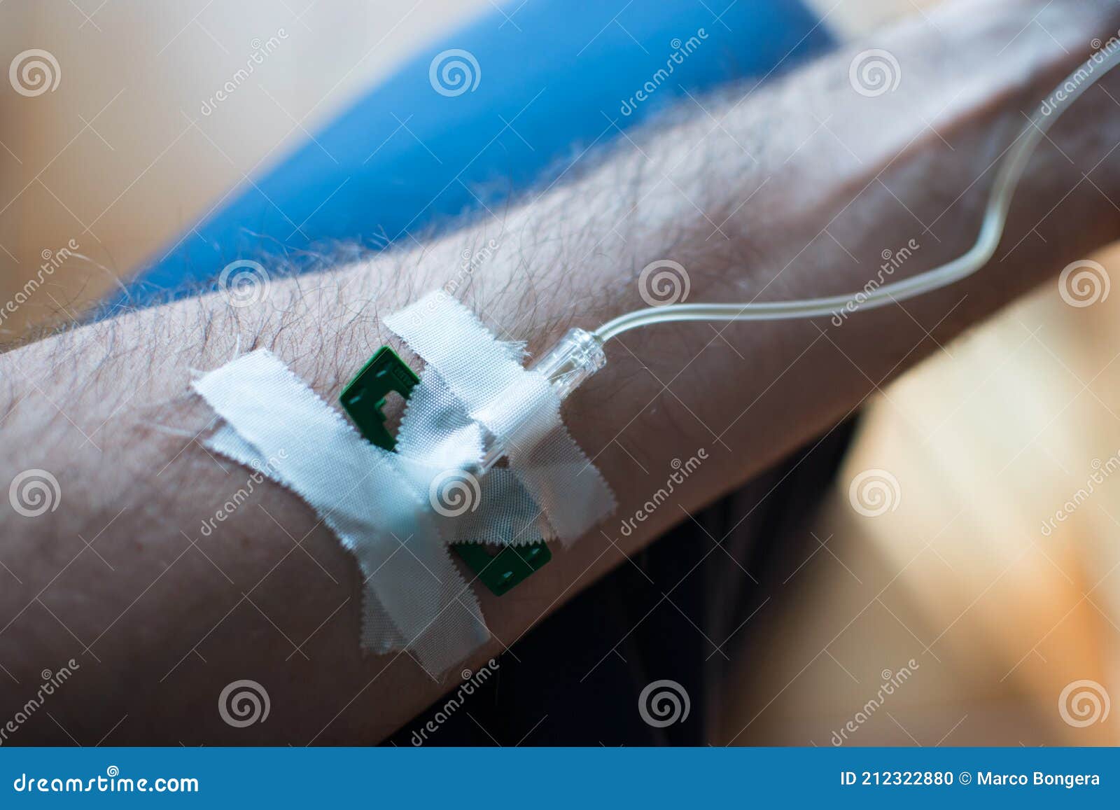 Detail of Arm with Drip Attached Stock Photo - Image of nurse ...