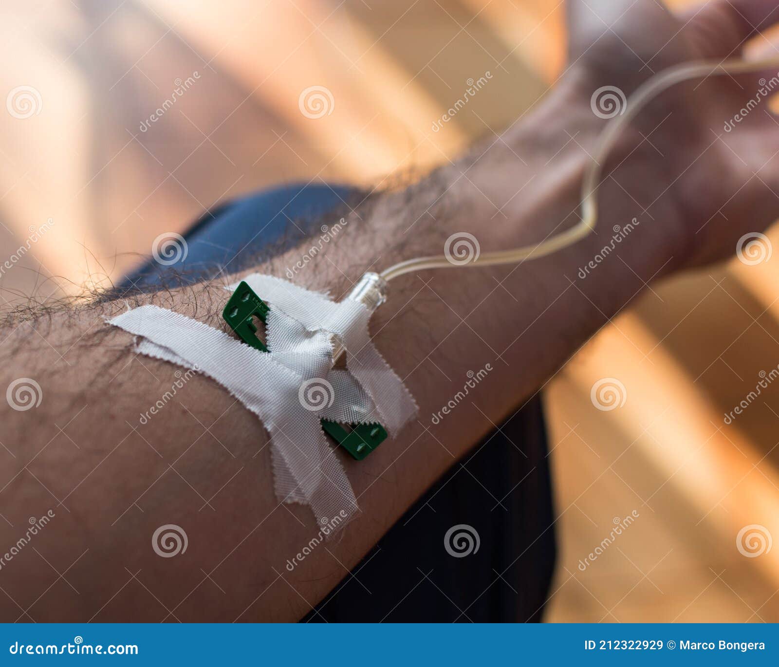 Detail of Arm with Drip Attached Stock Image - Image of mutation ...
