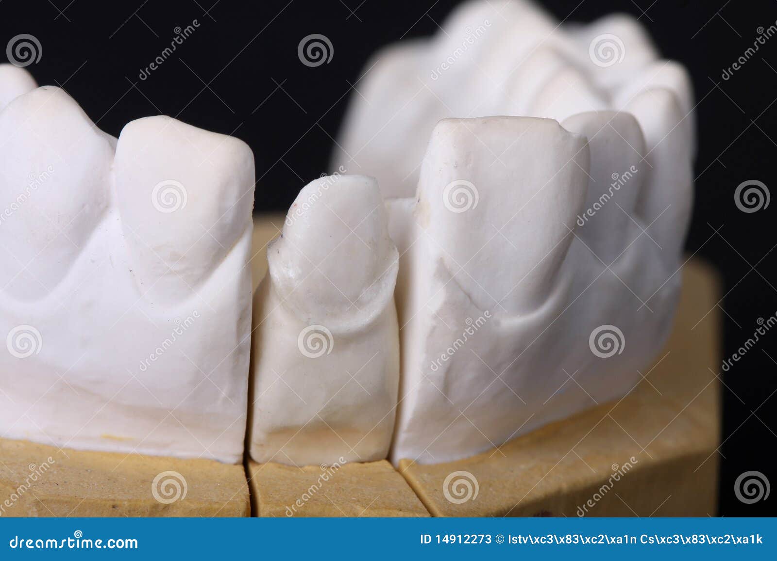 Detail dental wax model stock image. Image of prosthesis - 14912273