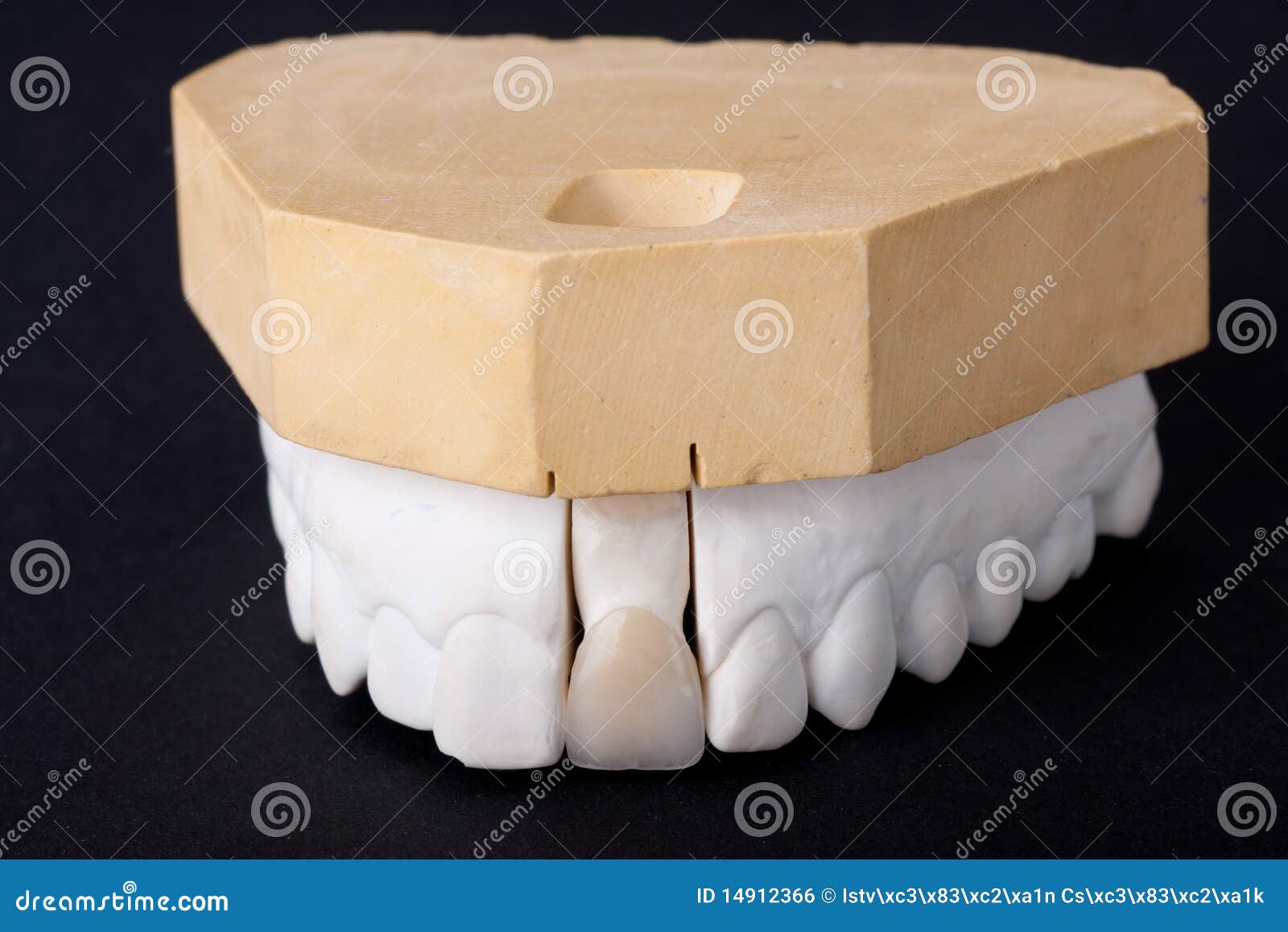 Detail dental wax model stock photo. Image of caries - 14912366