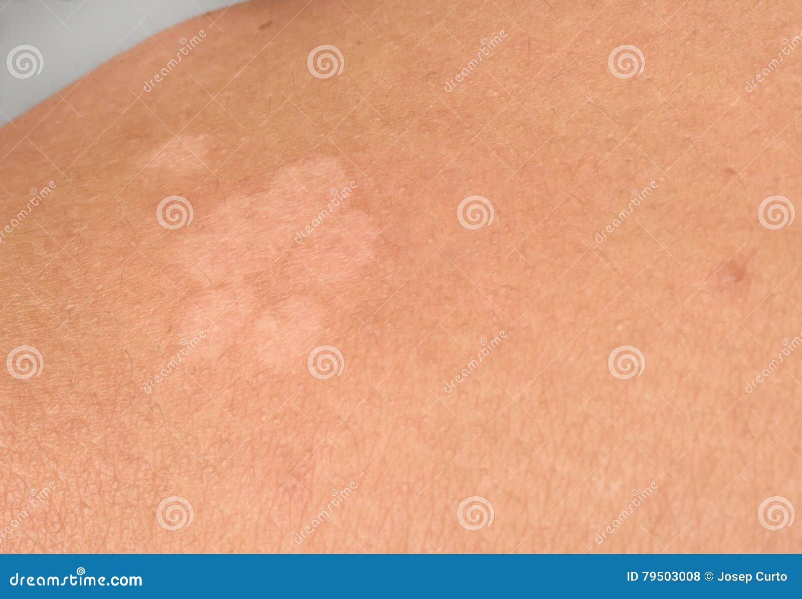 Detail des Hautpilzes stockfoto. Bild von bedingung, betrieb - 79503008