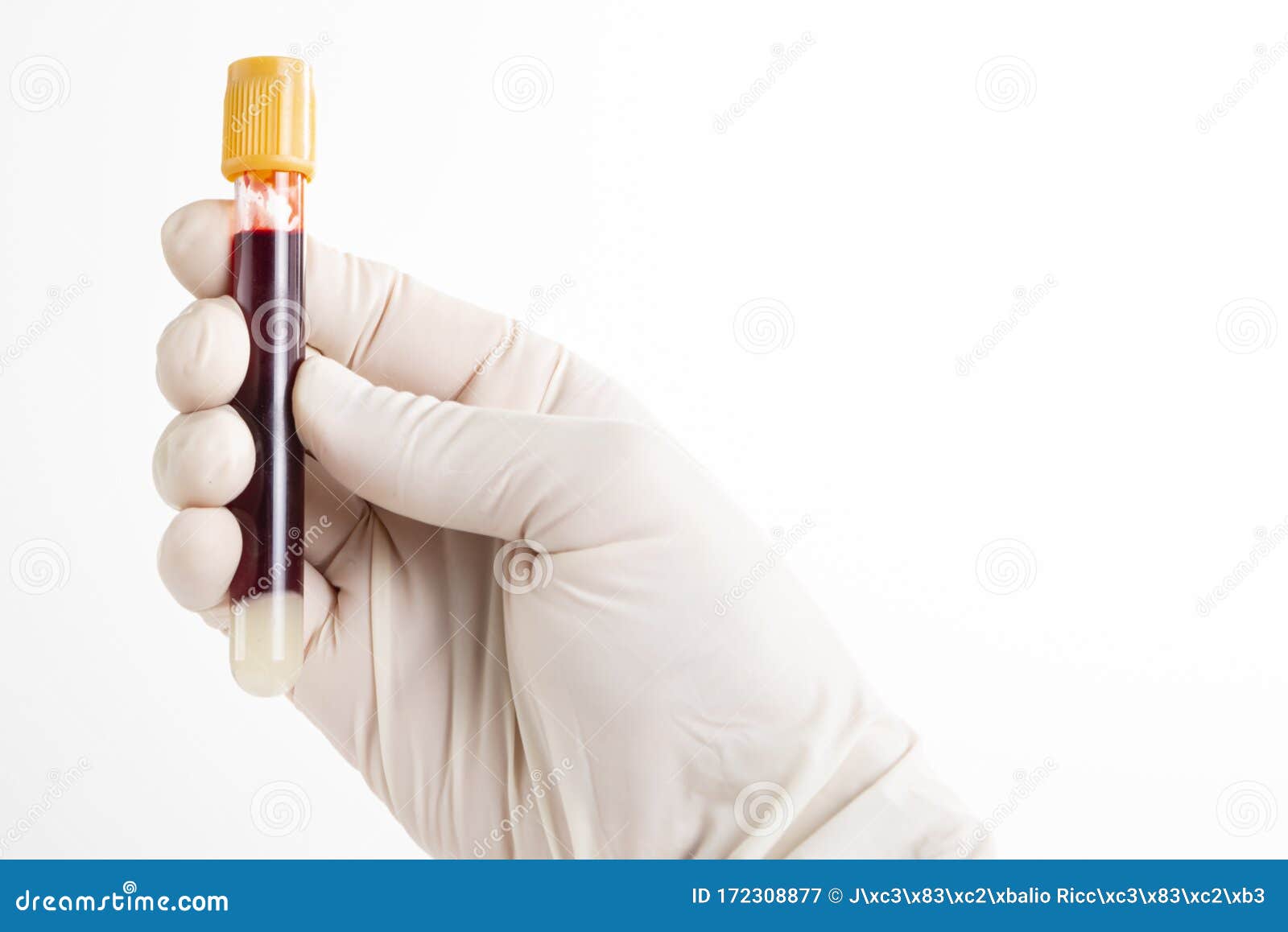 Detail of Everything from Blood Test on White Background Stock Image ...