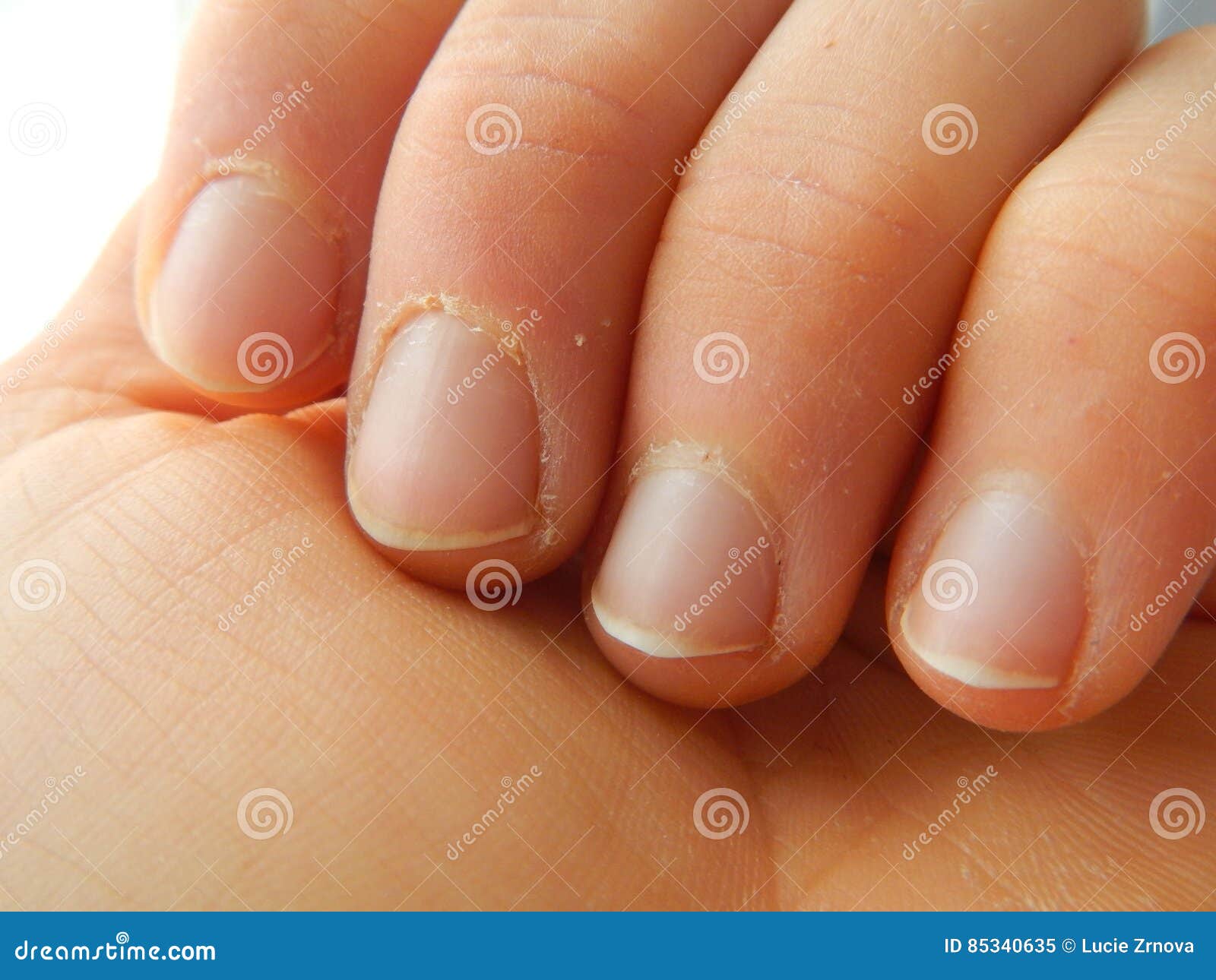 Detail of a Hand Fingers and Nails Stock Image - Image of manicure ...