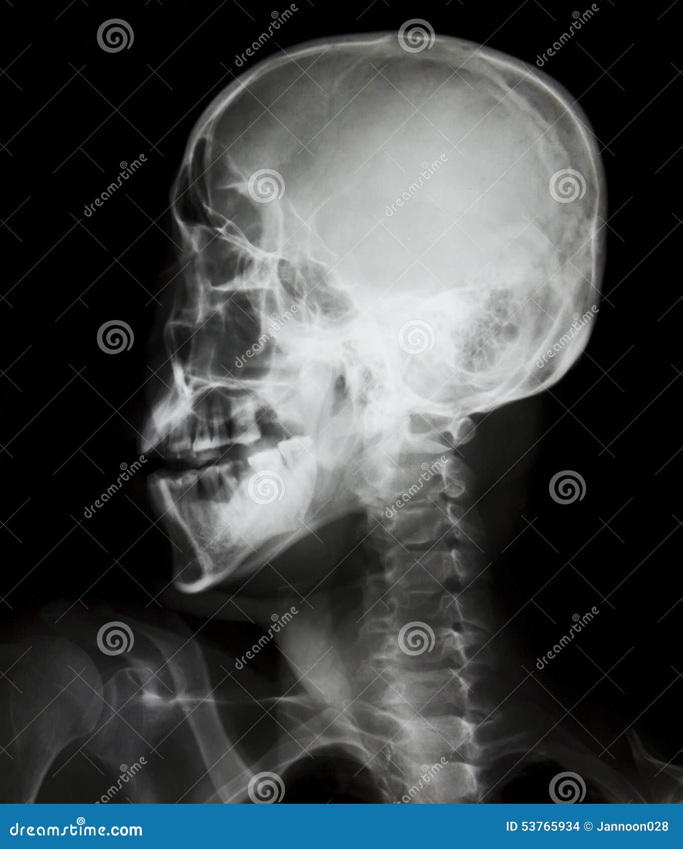 Detail of neck stock photo. Image of face, detail, report - 53765934