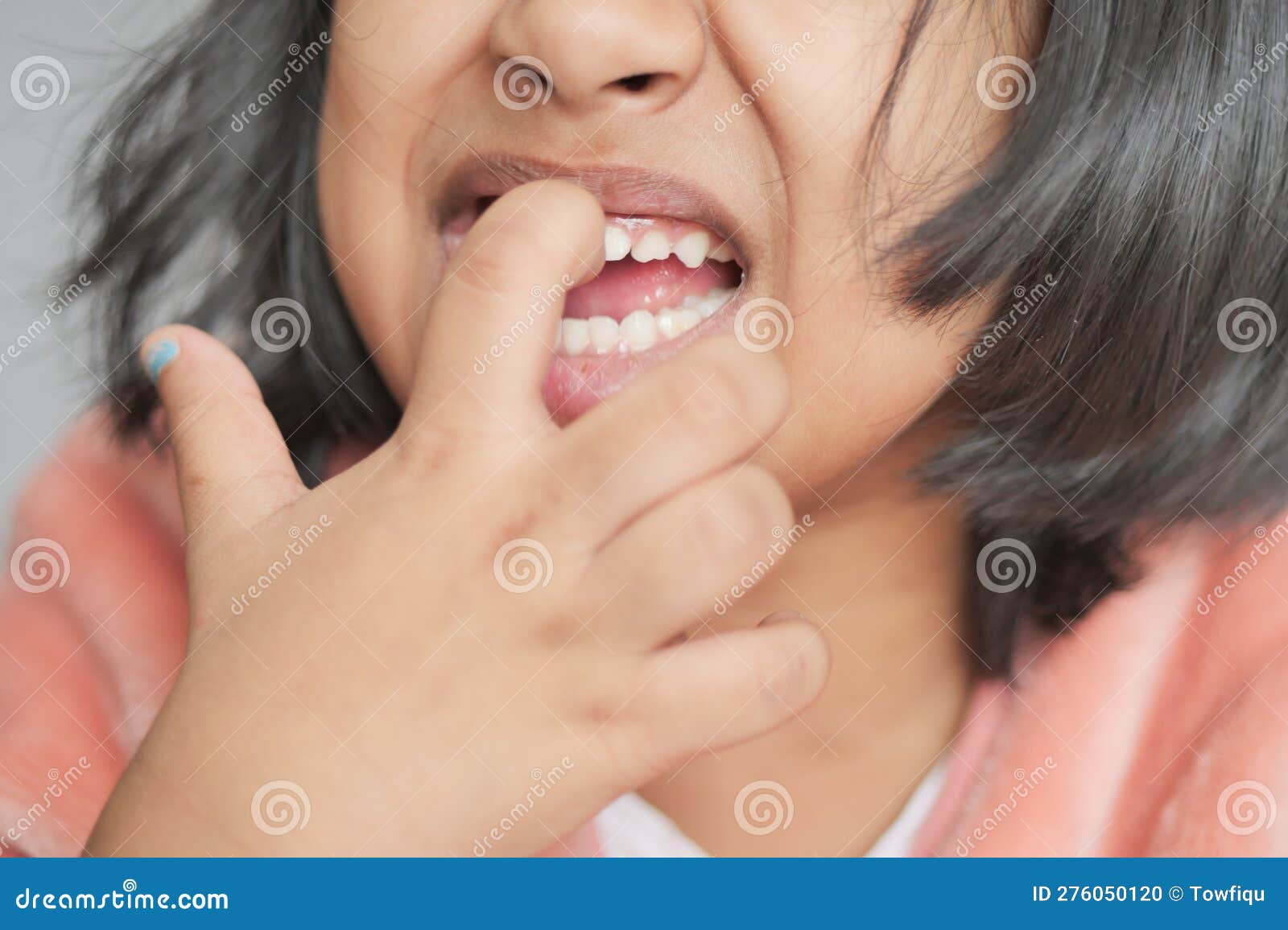 Detail Shot of Child with Teeth Missing Stock Photo - Image of missing ...