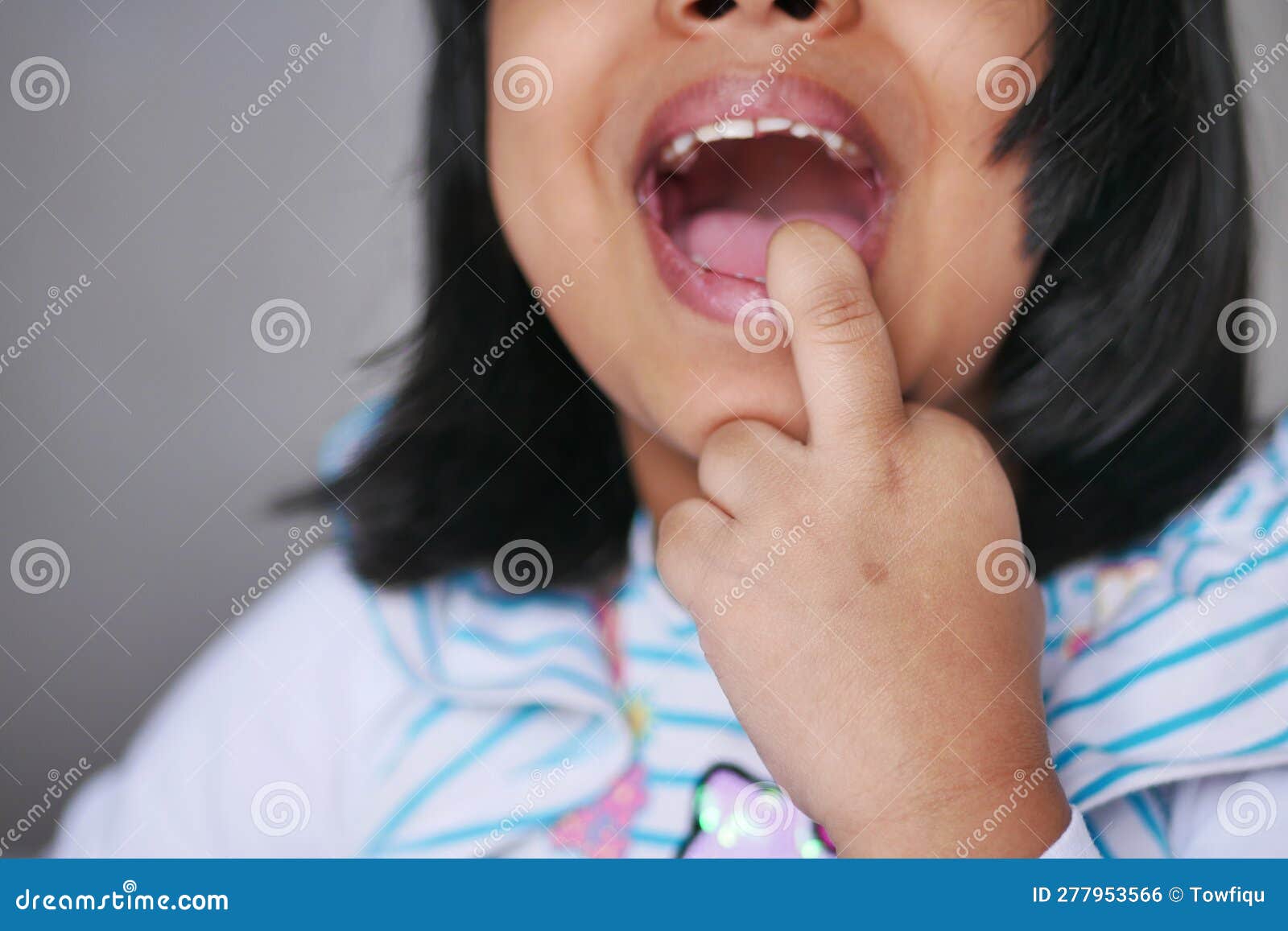 Detail Shot of Child with Teeth Missing Stock Photo - Image of face ...