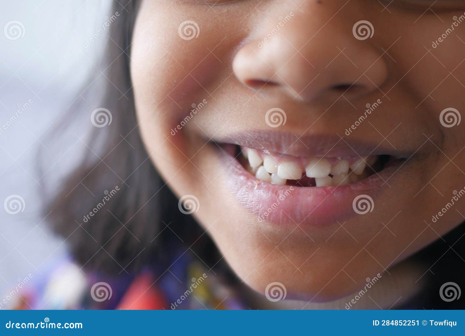 Detail Shot of Child with Teeth Missing Stock Image - Image of smile ...