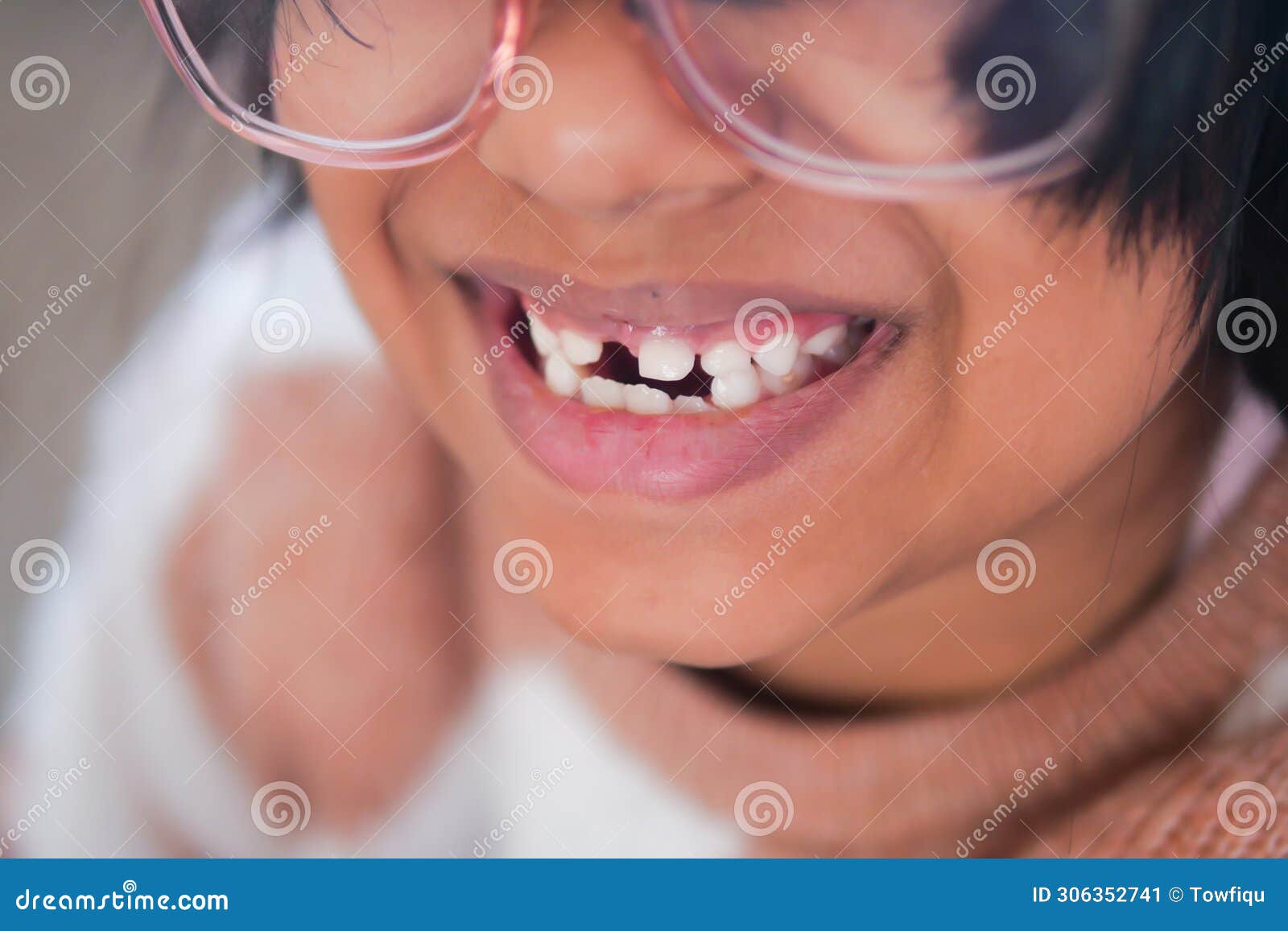 Detail Shot of Child with Teeth Missing Stock Image - Image of growth ...
